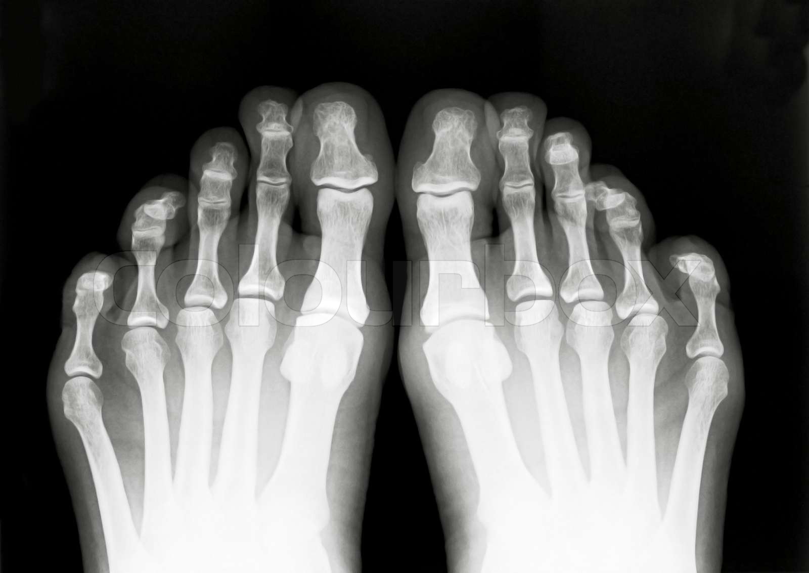 Foot fingers | Stock image | Colourbox