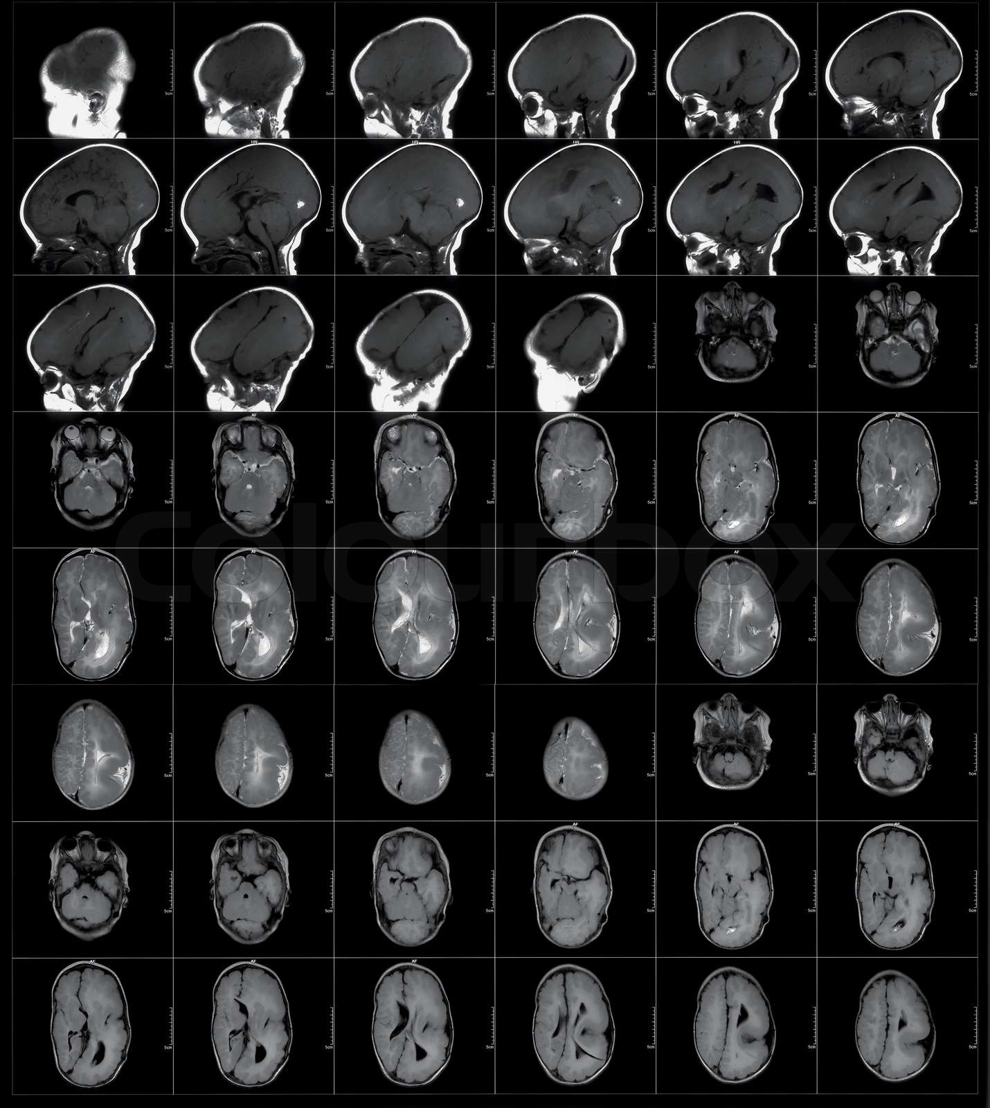 MRI | Stock image | Colourbox