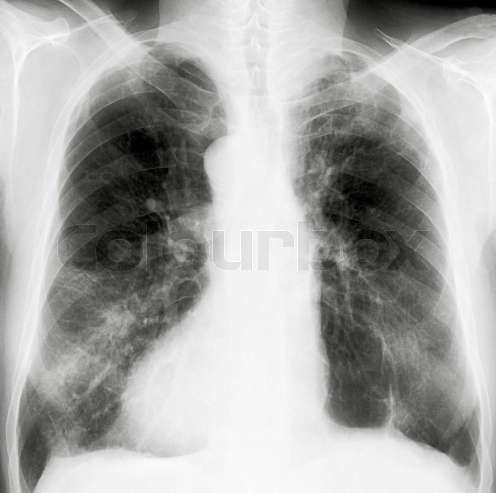 X-Ray | Stock image | Colourbox