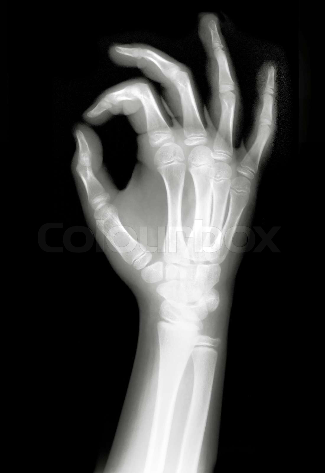 Röntgen Hand | Stock Bild | Colourbox