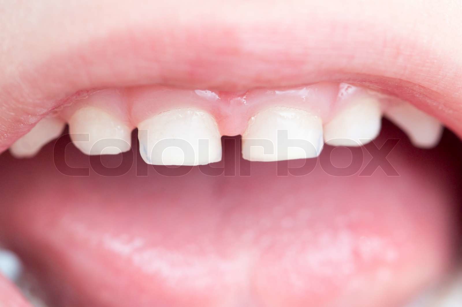 baby teeth. macro | Stock image | Colourbox