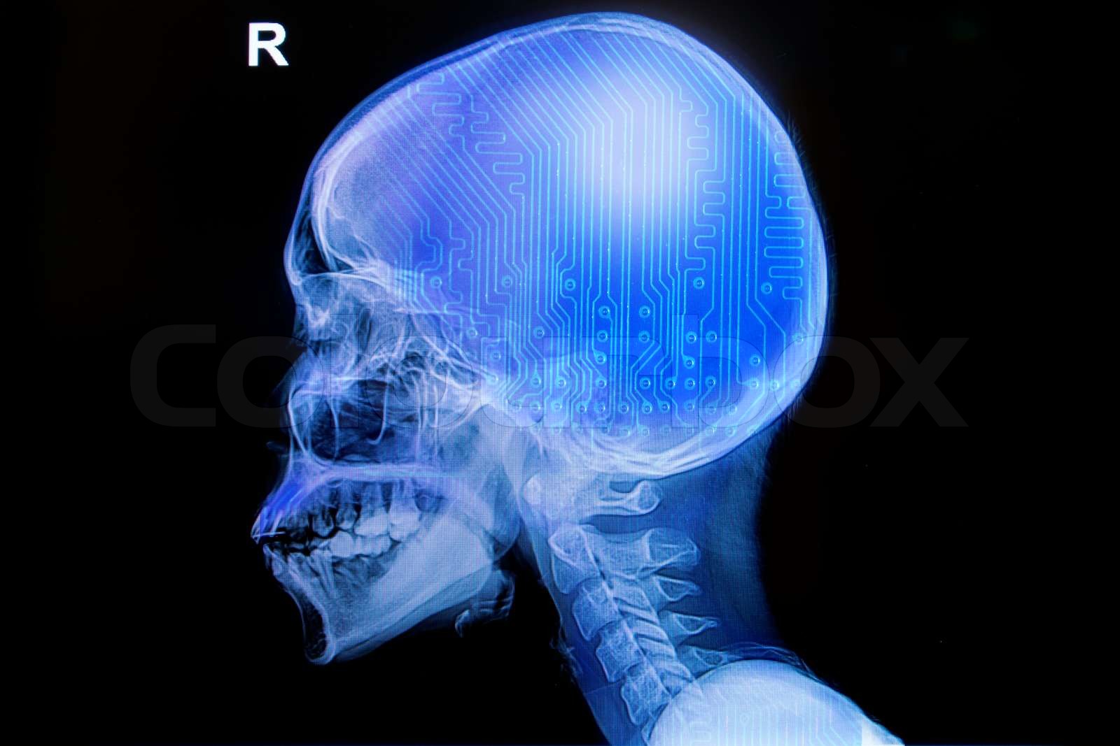Skull x-rays image with computer chip and circuit | Stock image | Colourbox