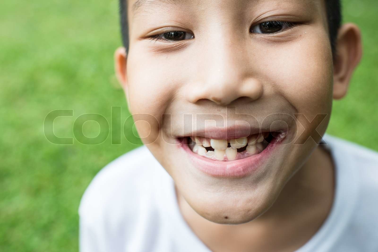 Asian Boy Showing Missing Teeth Stock Image Colourbox