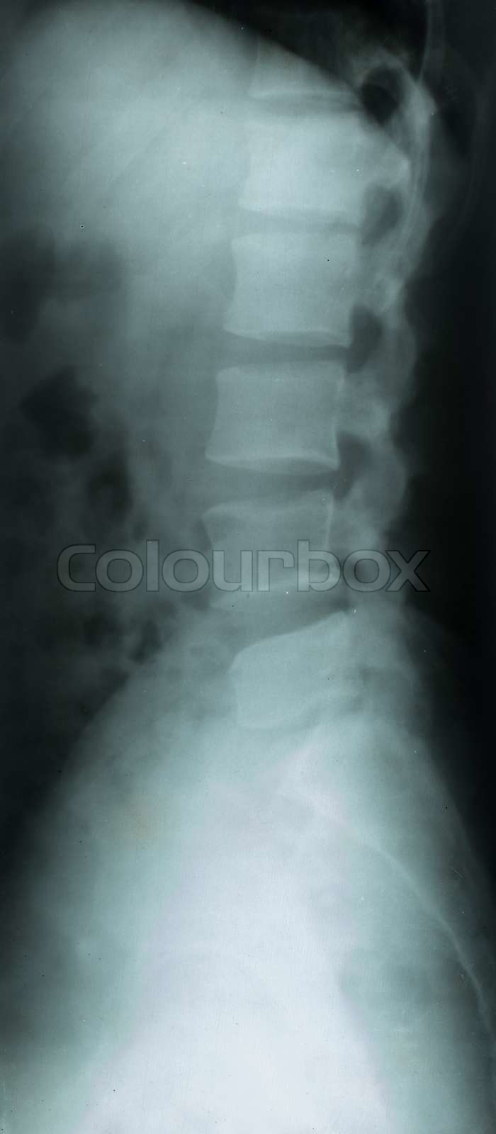X-rays of human neck bone | Stock image | Colourbox