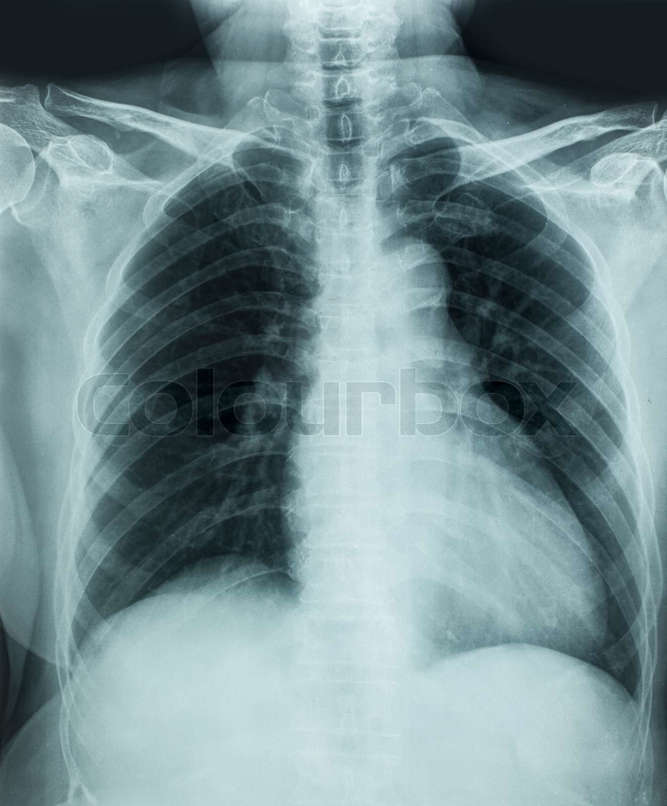 X-Ray | Stock image | Colourbox