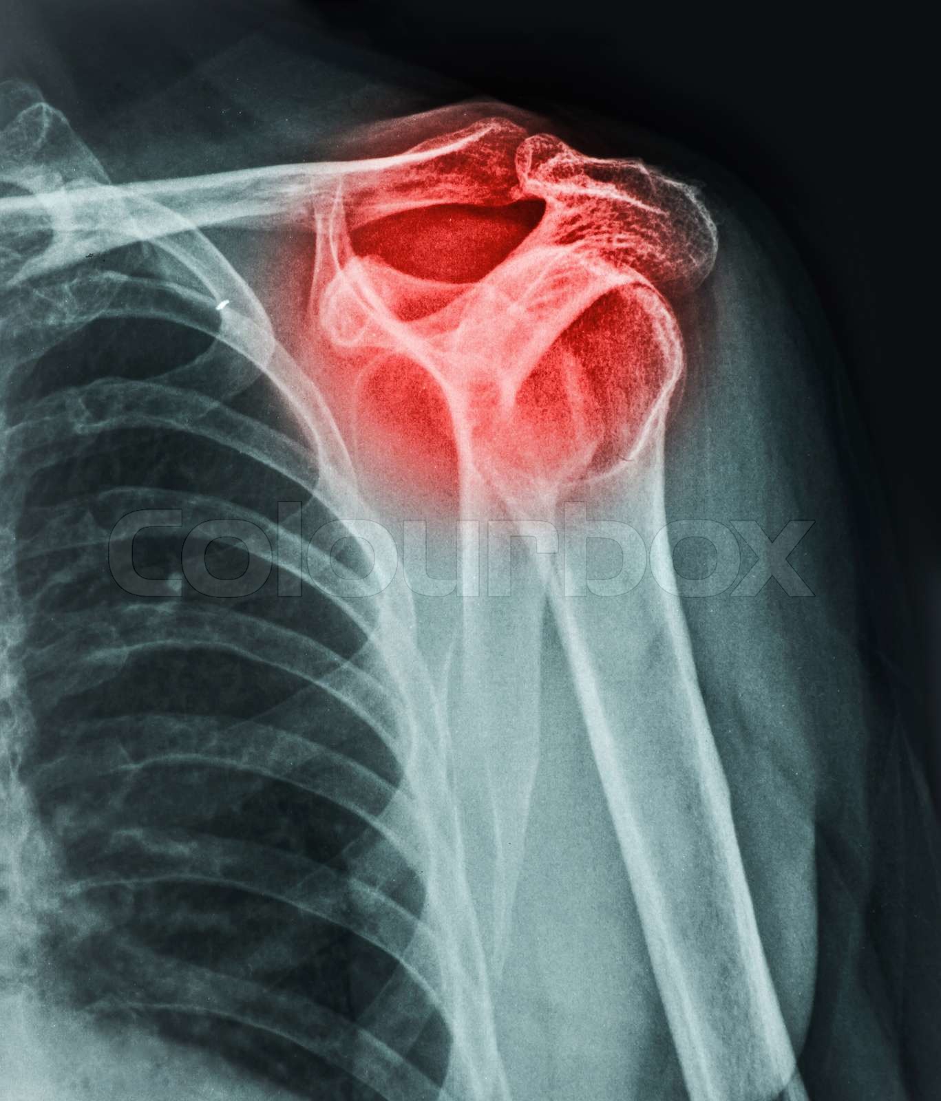 X-Ray | Stock image | Colourbox
