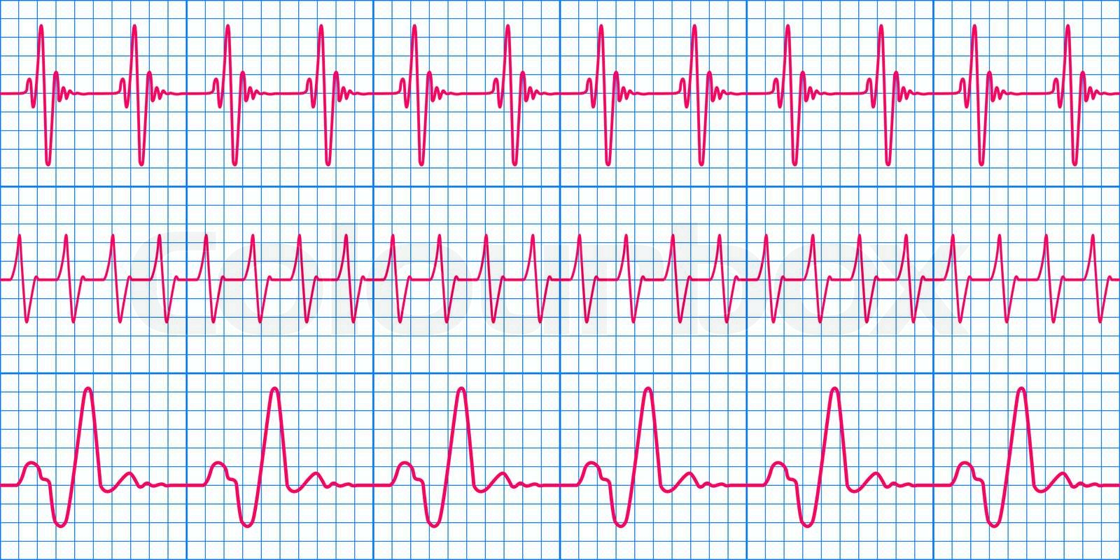 Cardiogram | Stock vector | Colourbox