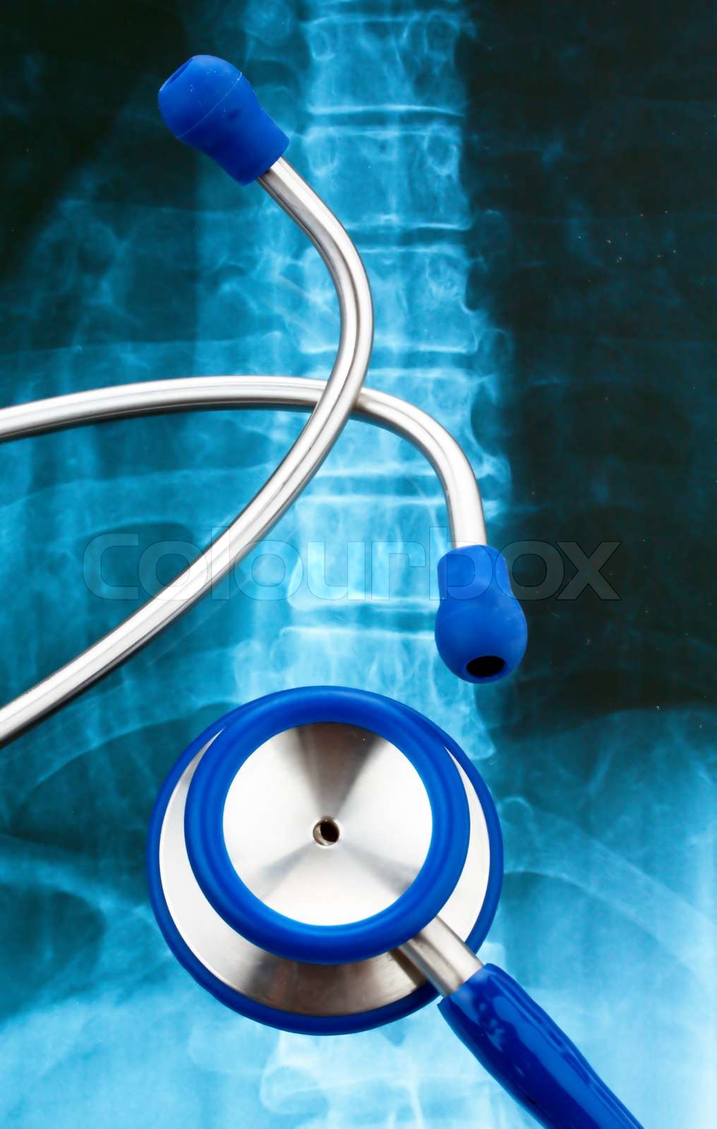 A radiograph and a stethoscope. Example picture of illness. | Stock ...