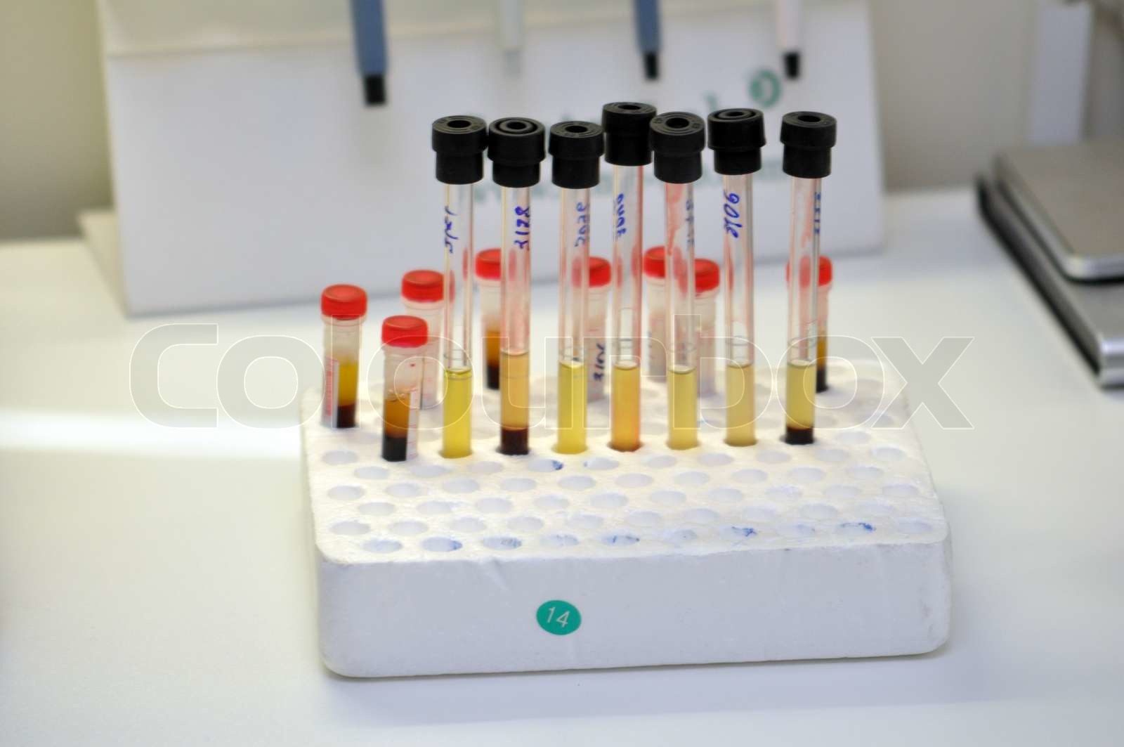 Test-tubes for urinalysis | Stock image | Colourbox