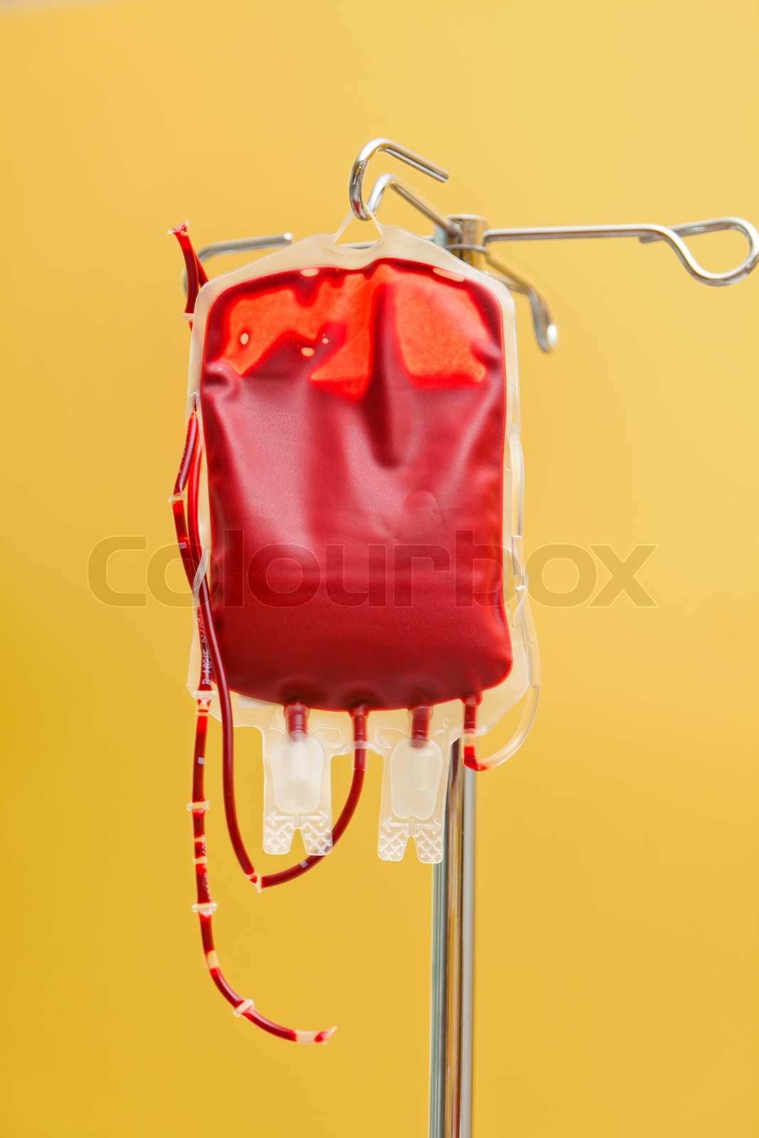 A pouch of blood for infusion into a clinic. Donor blood is ...