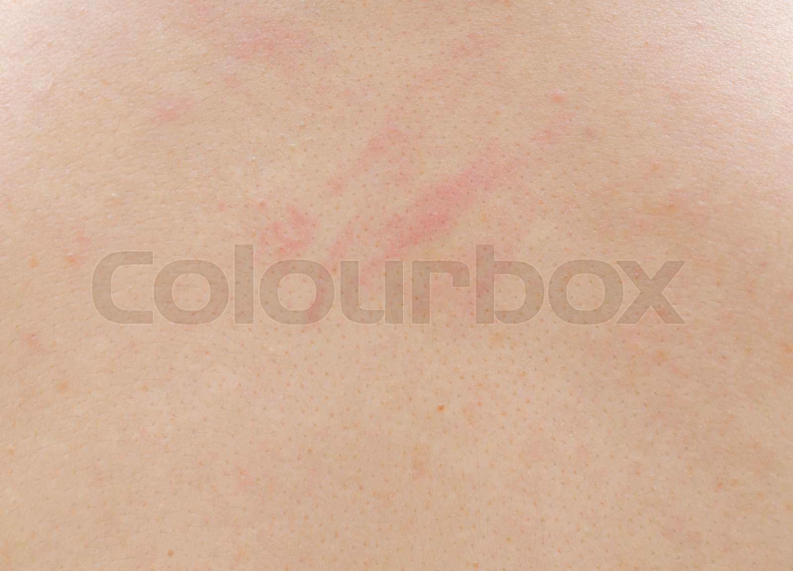 close up view of human skin | Stock image | Colourbox