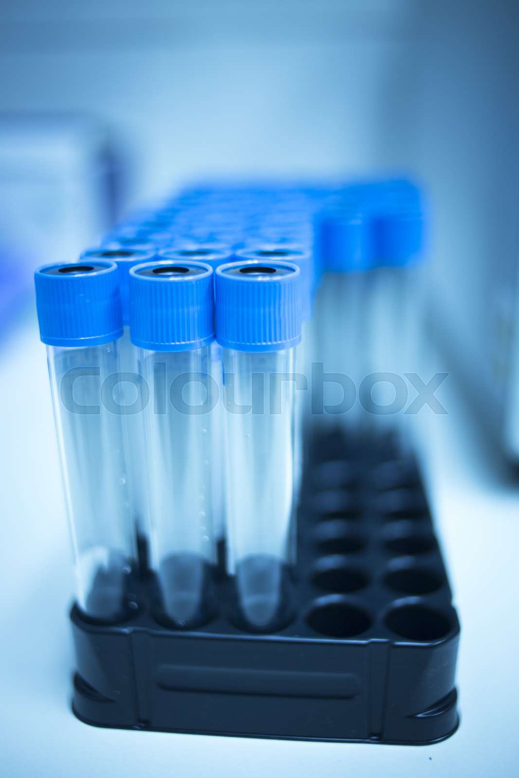 Medical laboratory test tubes PRP platelet rich plasma | Stock image ...