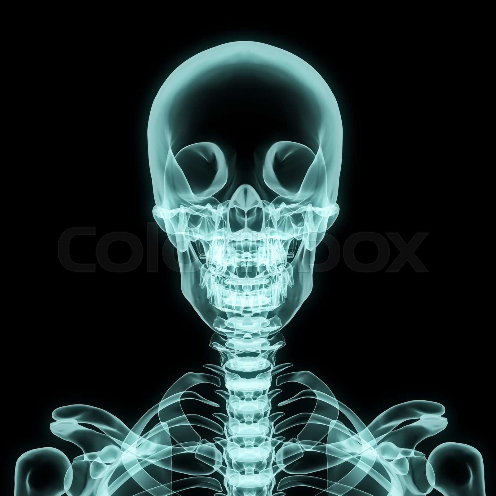 X-ray upper chest included skull | Stock image | Colourbox