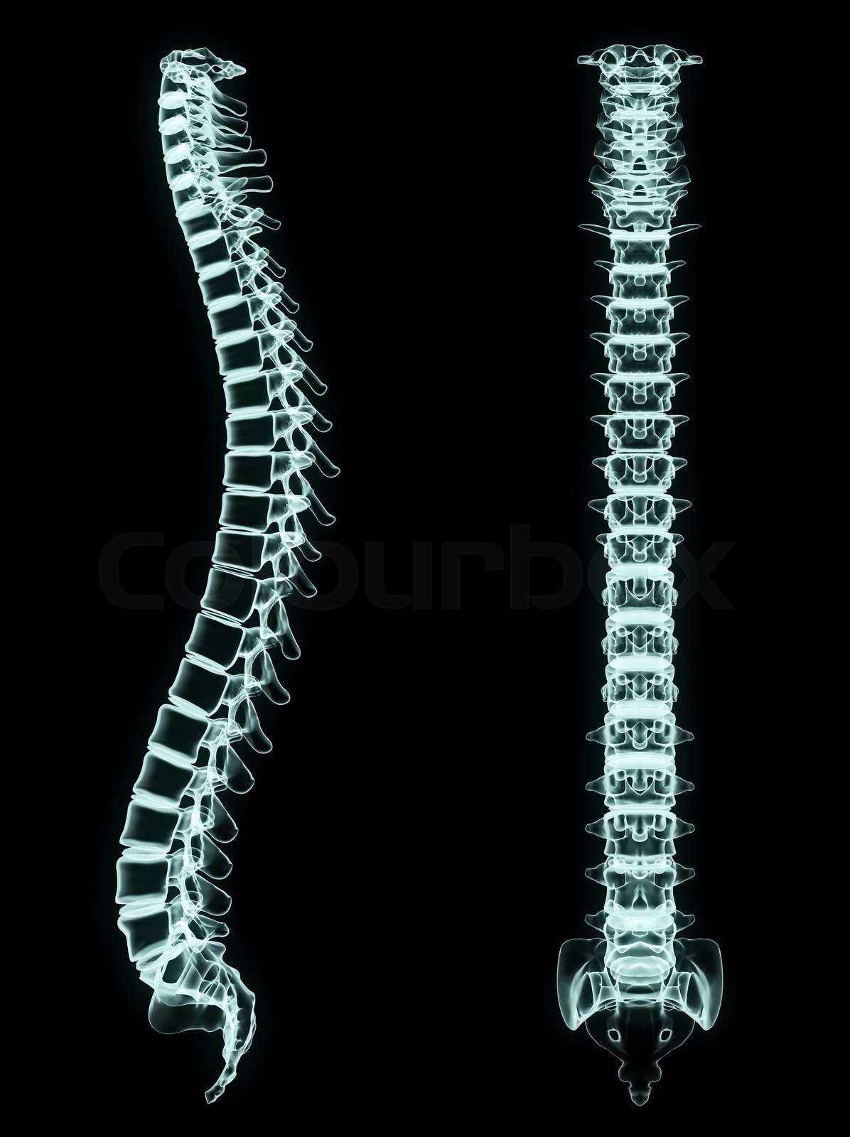 X-ray spine front and side | Stock image | Colourbox