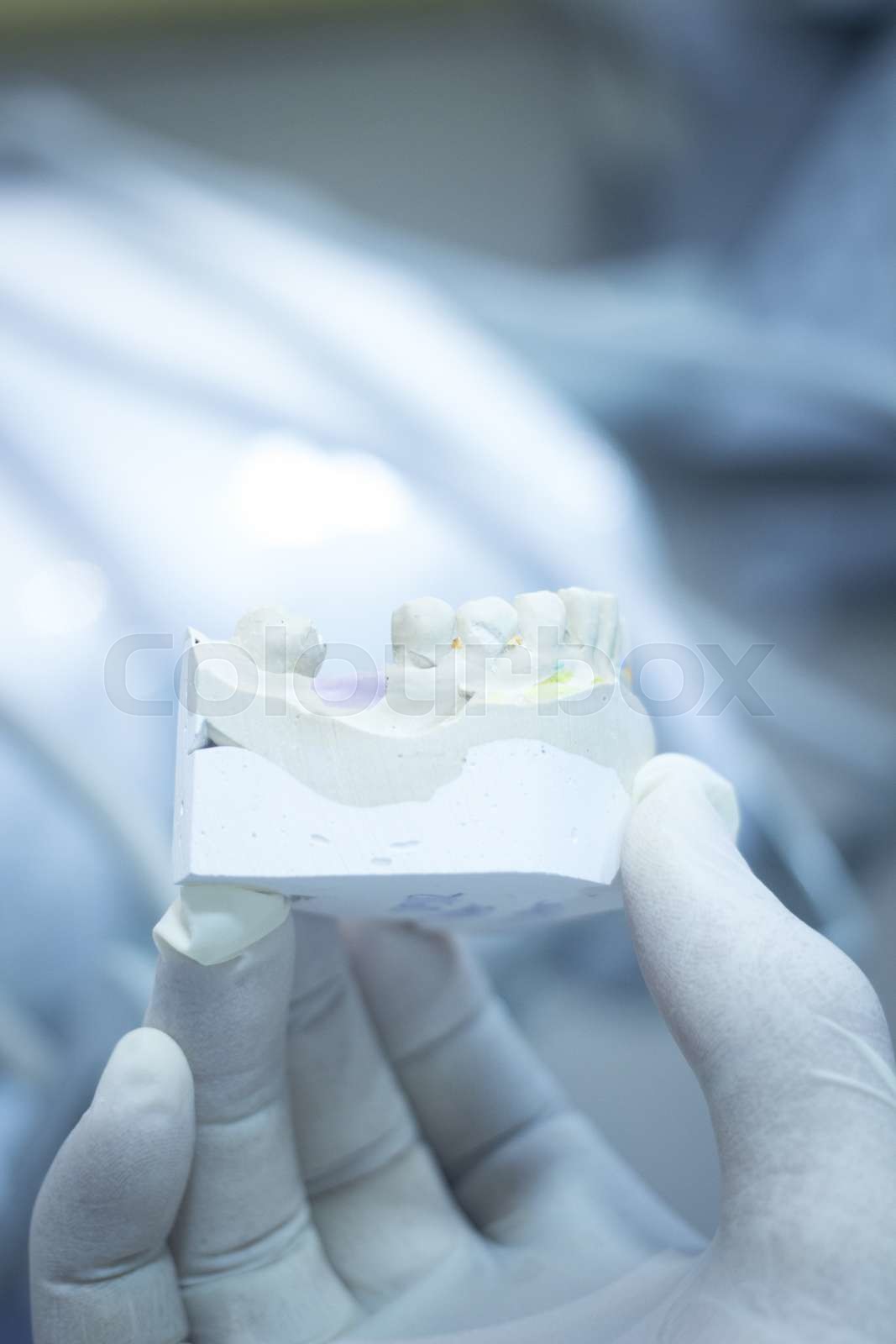 Dental mold dentist clay teeth ceramic plate model cast | Stock image ...