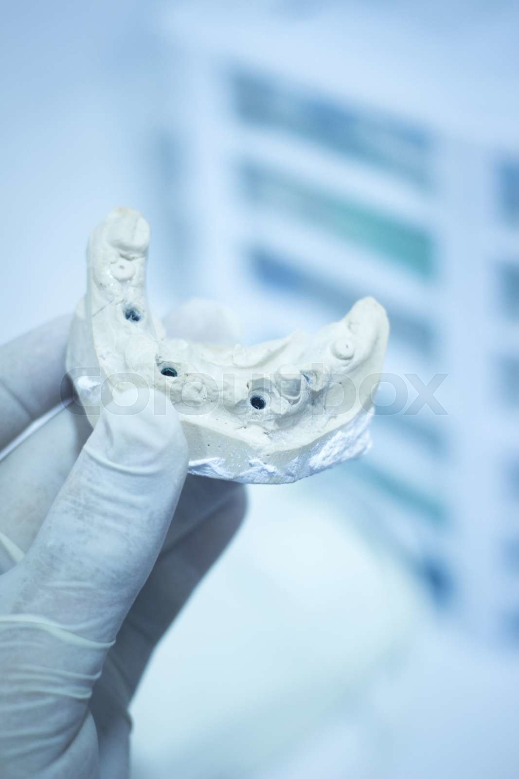 Dental mold dentist clay teeth ceramic plate model cast | Stock image ...