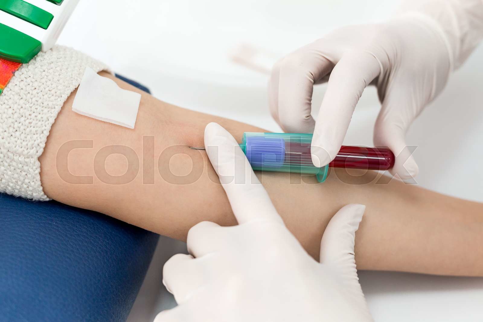 Blood test from vein | Stock image | Colourbox