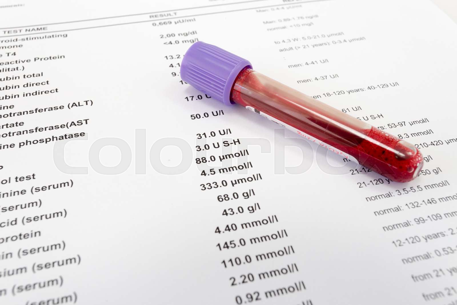 Red blood in test tube on white blank | Stock image | Colourbox