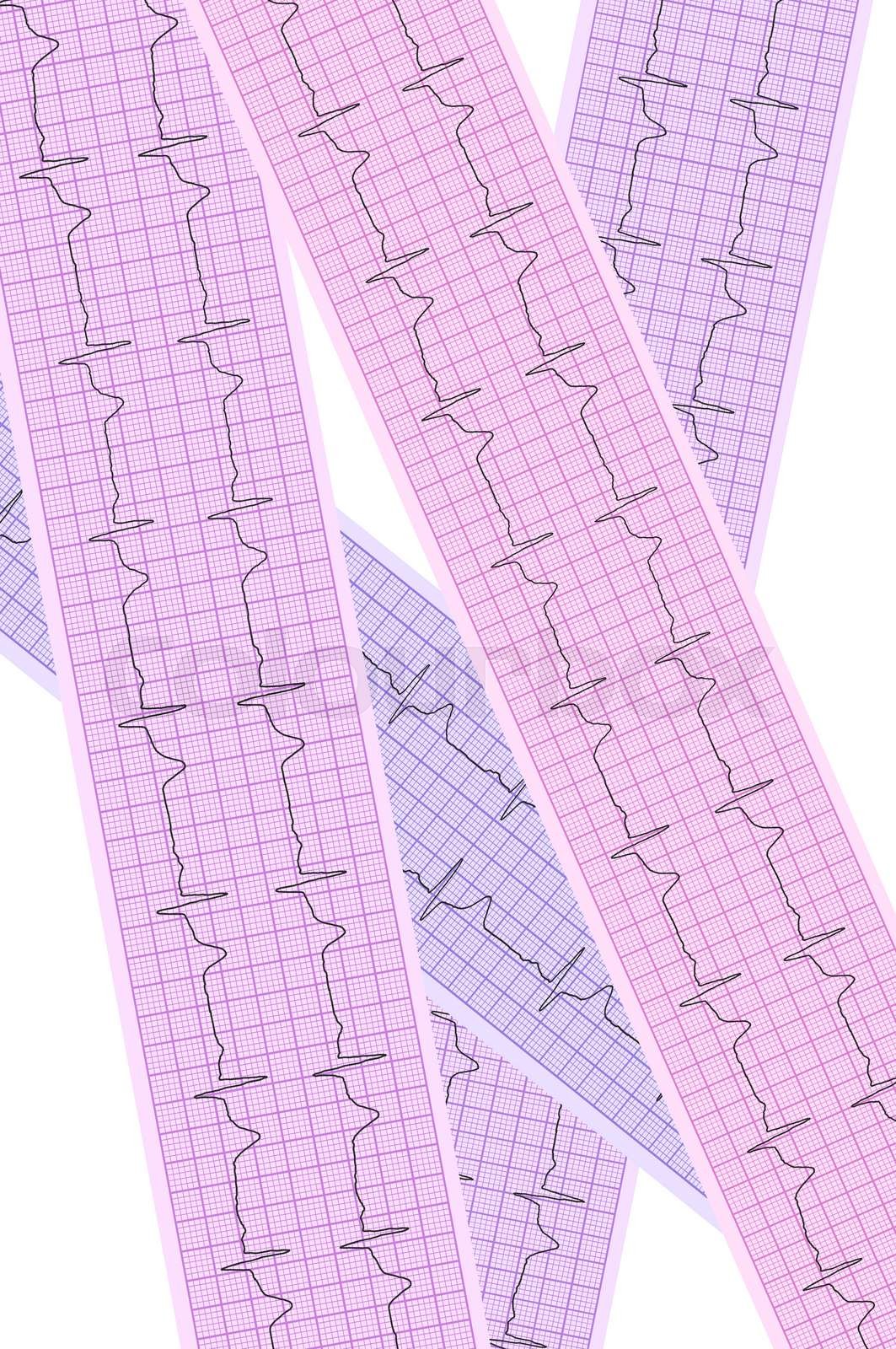Heart analysis, electrocardiogram graph (ECG) | Stock image | Colourbox