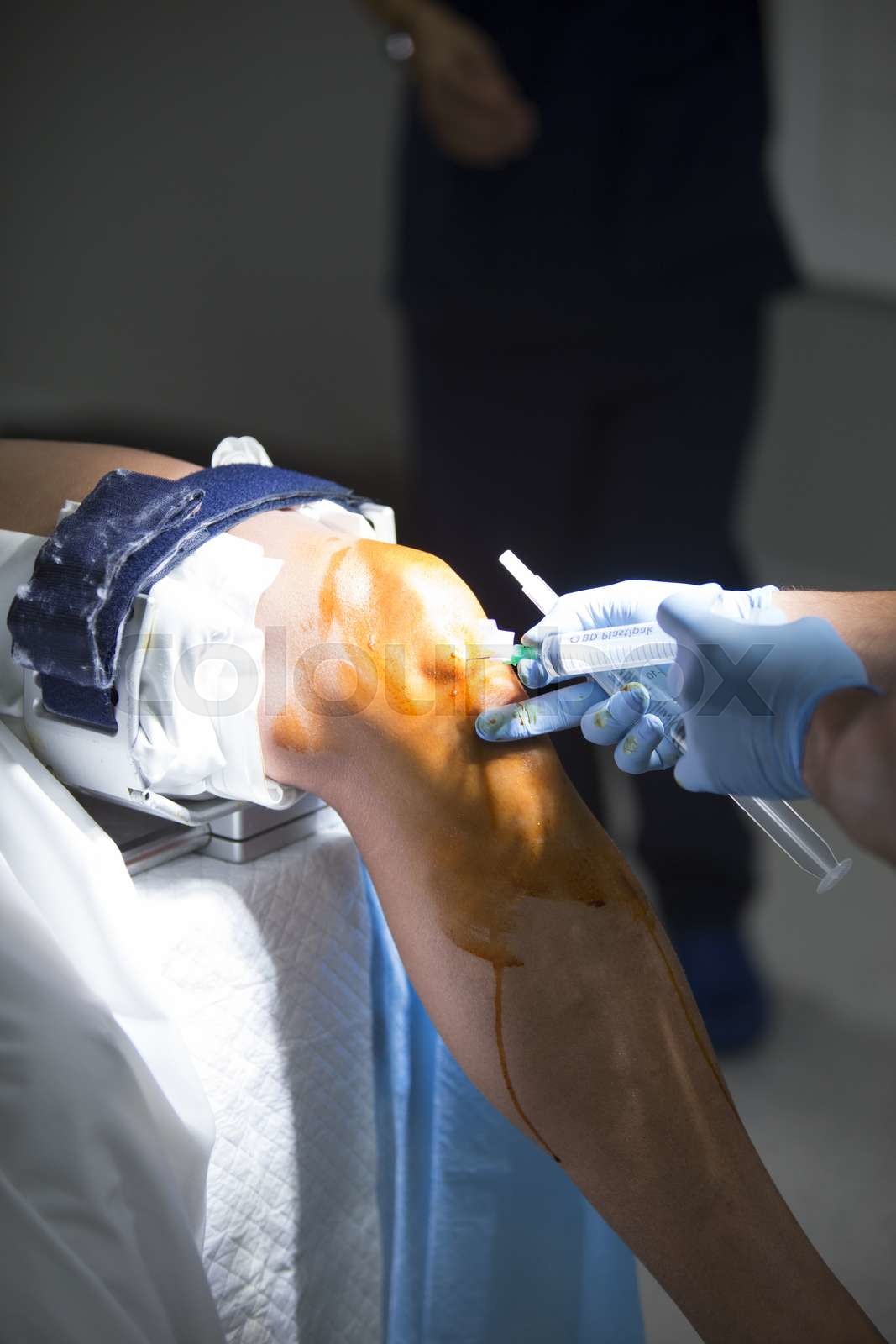 Orthopedics surgery knee arthroscopy anaesthetic | Stock image | Colourbox