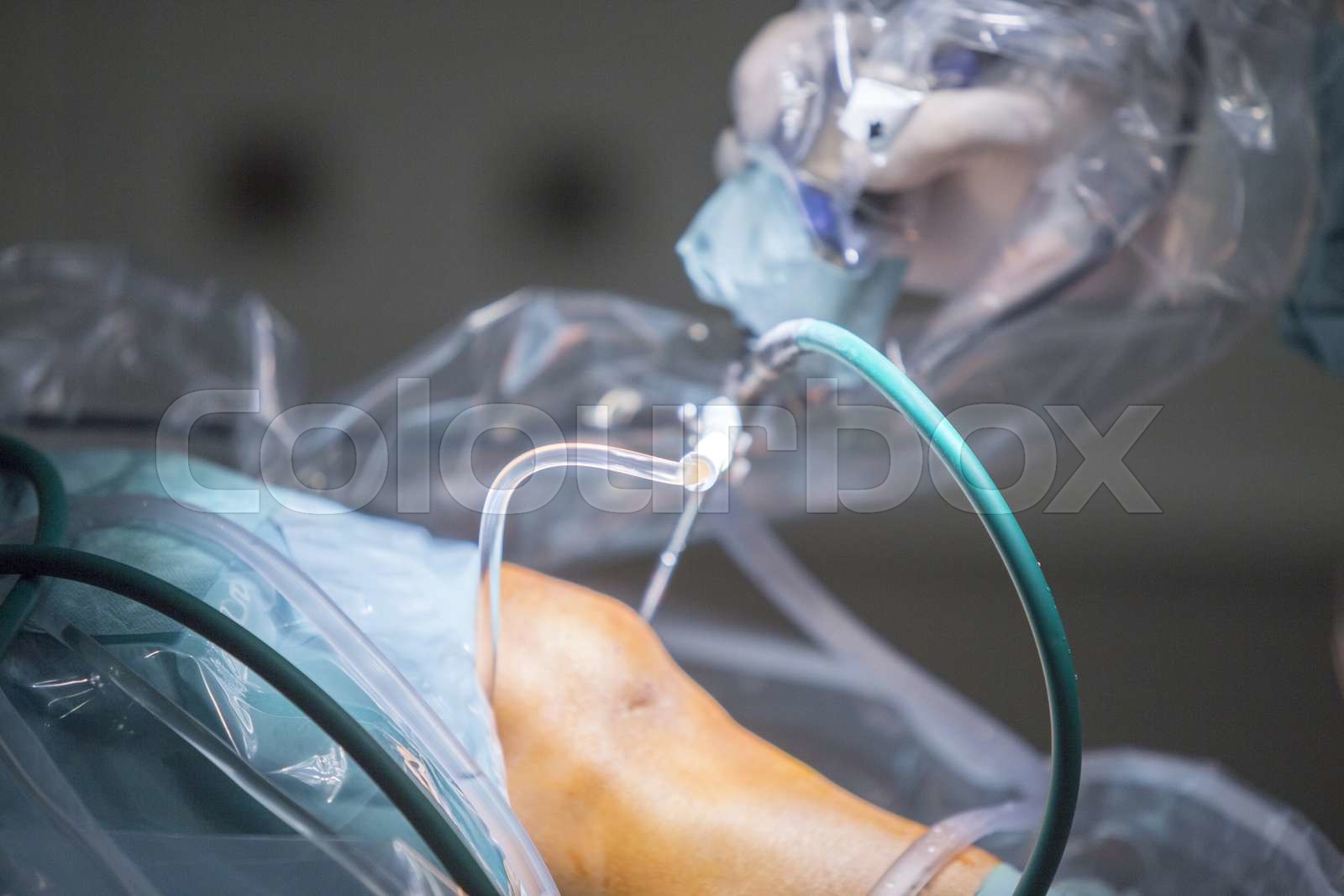 Arthroscopy orthopedic surgery knee arthroscope probe | Stock image ...