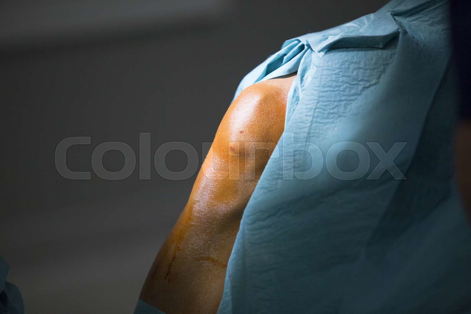 Traumatology orthopedic surgery knee arthroscopy | Stock image | Colourbox