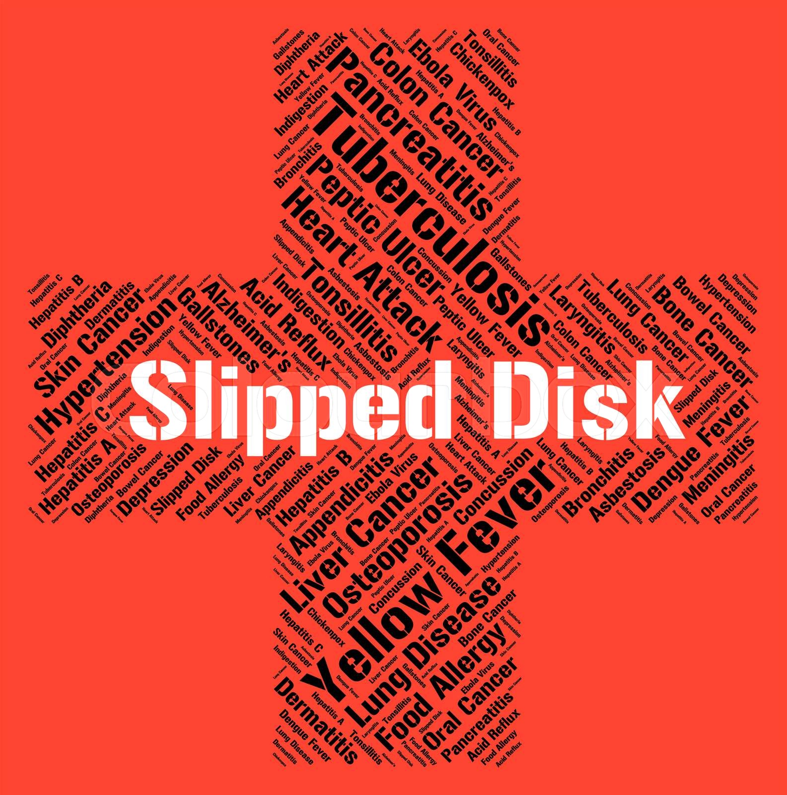 Slipped Disc Represents Lifting Injuries And Bulge | Stock image ...