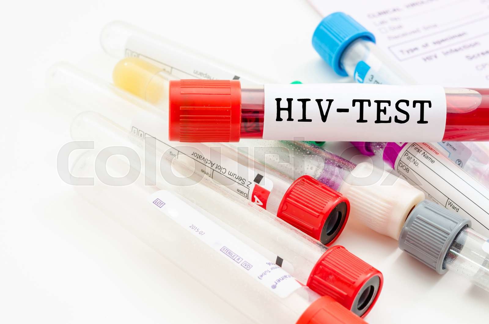 Sample blood collection tube with HIV test. | Stock image | Colourbox