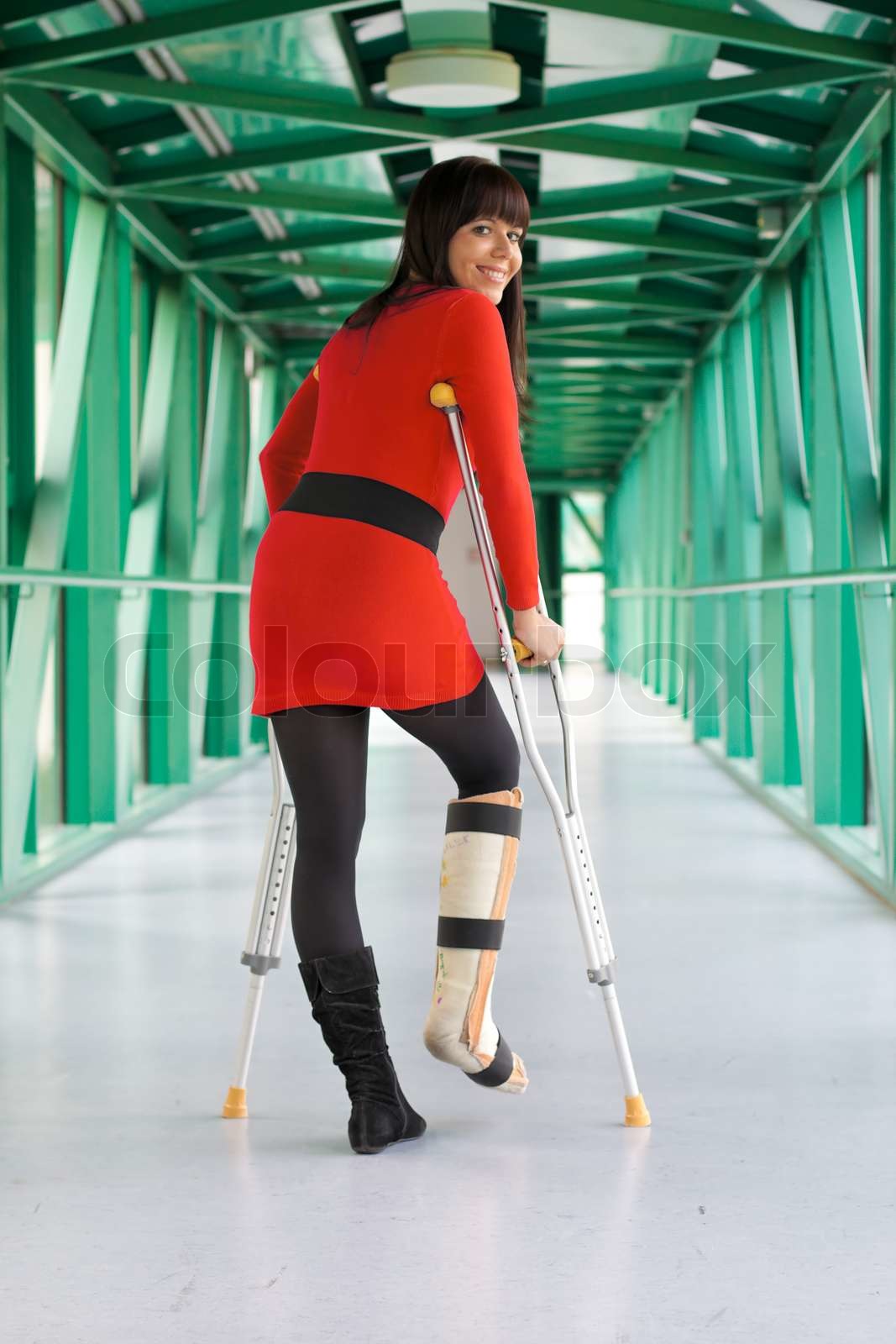Young woman with leg cast in hospital | Stock image | Colourbox