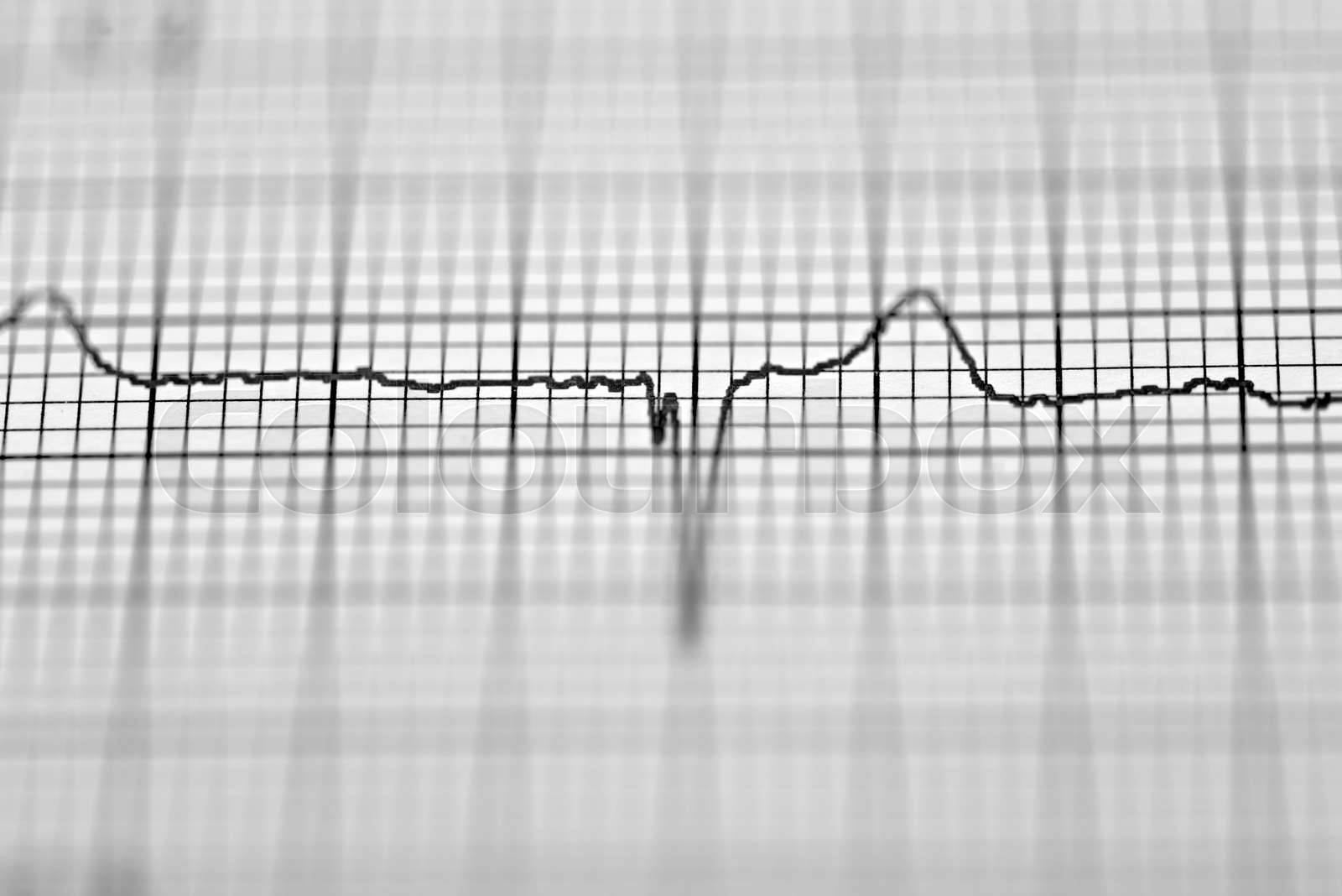 Electrocardiogram | Stock image | Colourbox