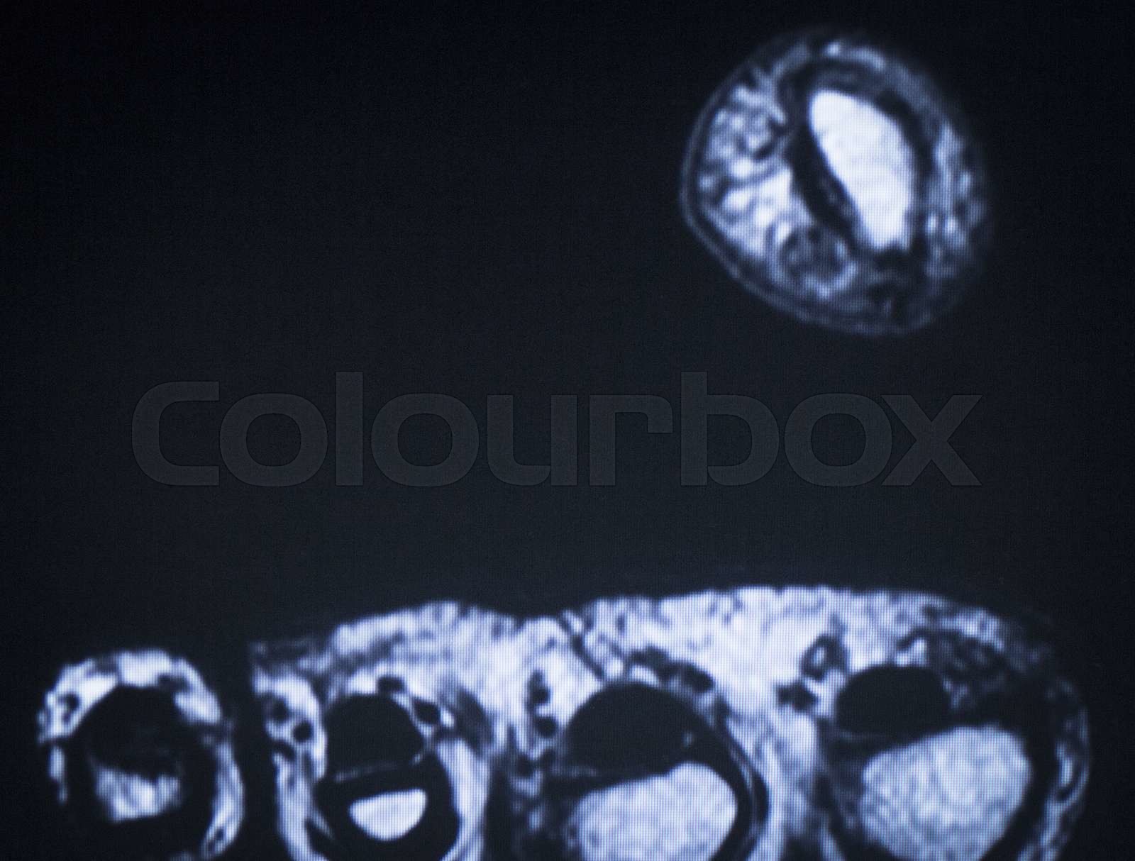 MRI magnetic resonance imaging foot toes scan | Stock image | Colourbox