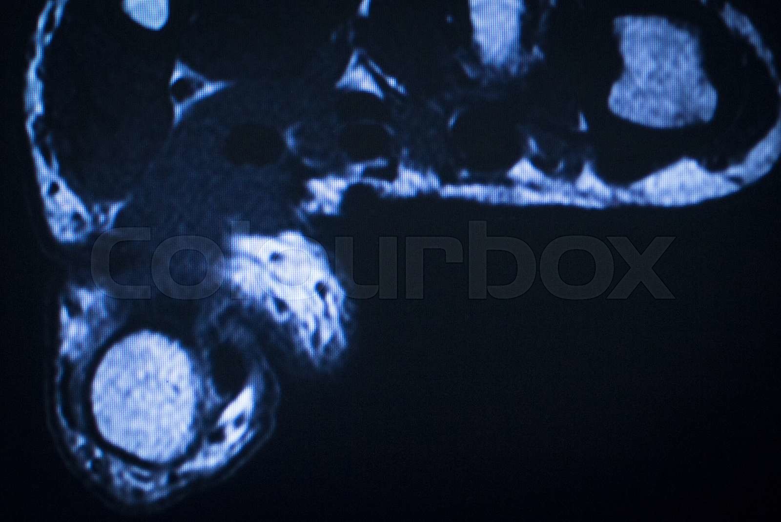 MRI magnetic resonance imaging foot toes scan | Stock image | Colourbox
