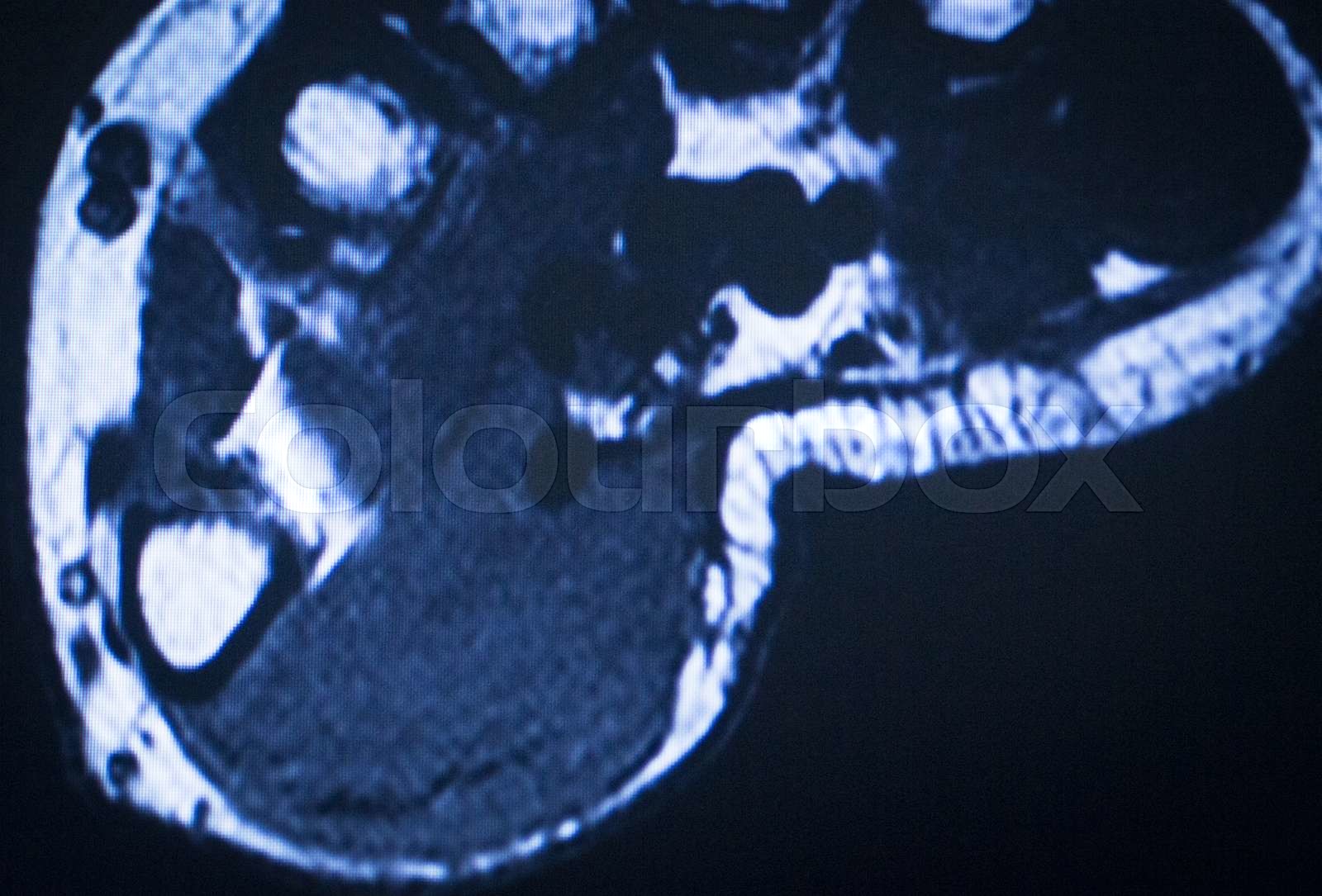 MRI magnetic resonance imaging foot toes scan | Stock image | Colourbox