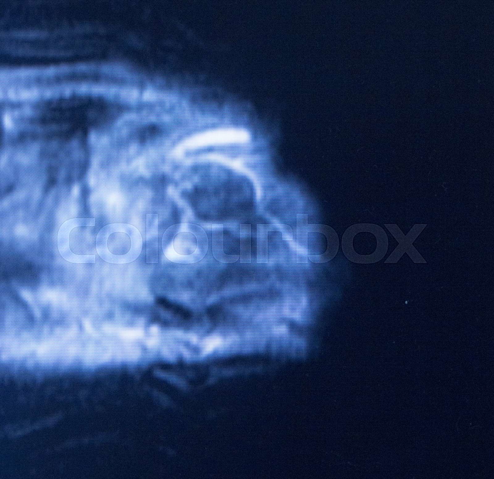 MRI magnetic resonance imaging hand finger scan | Stock image | Colourbox