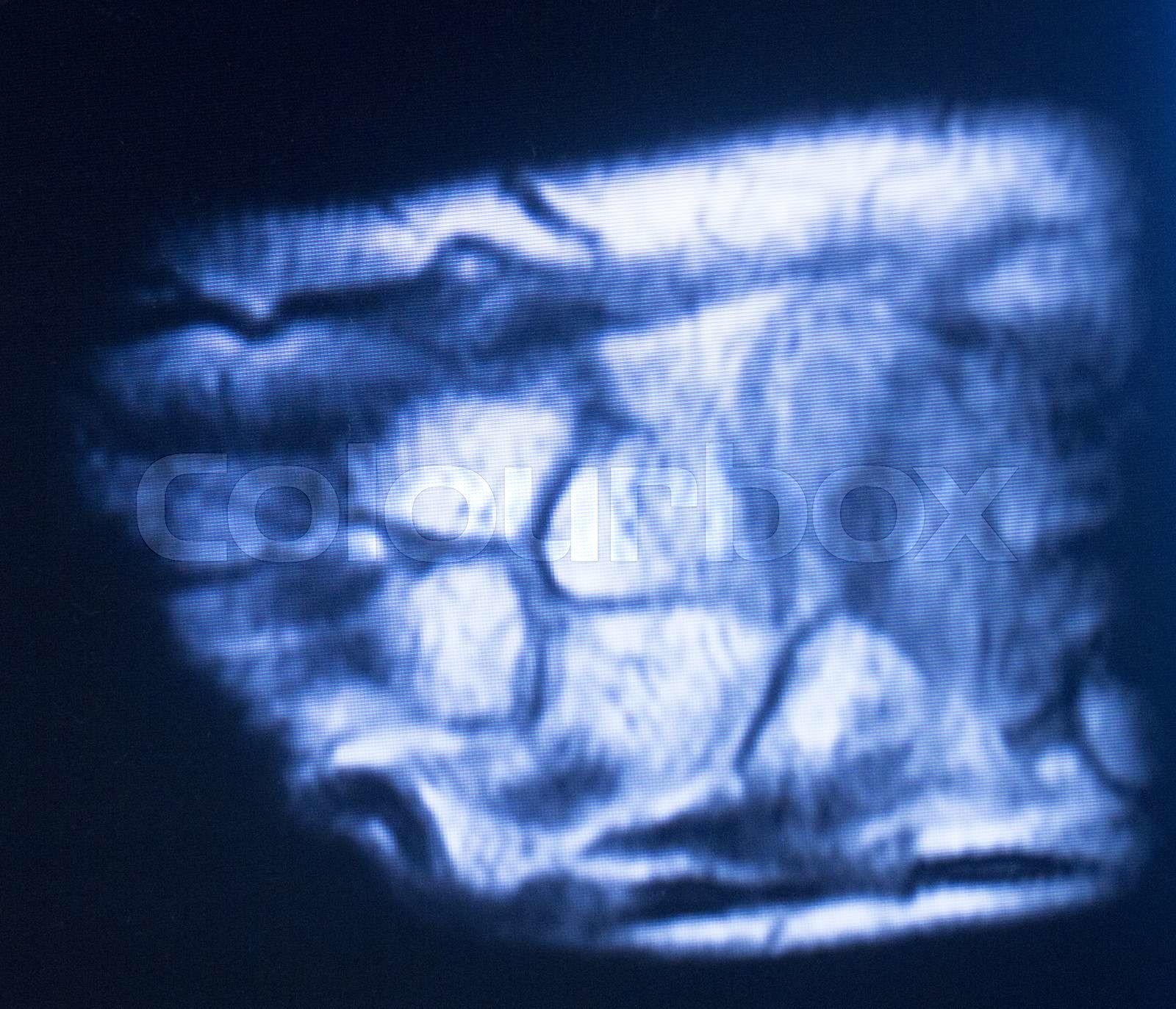 MRI magnetic resonance imaging hand finger scan | Stock image | Colourbox