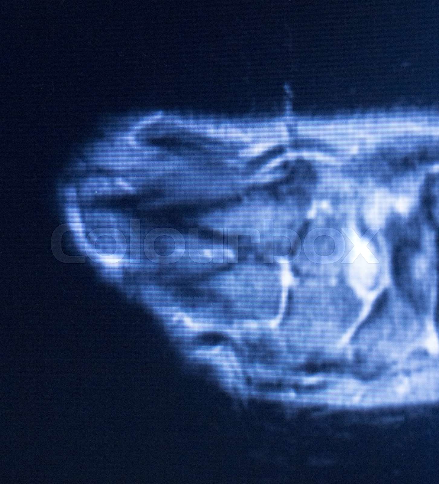 MRI magnetic resonance imaging hand finger scan | Stock image | Colourbox