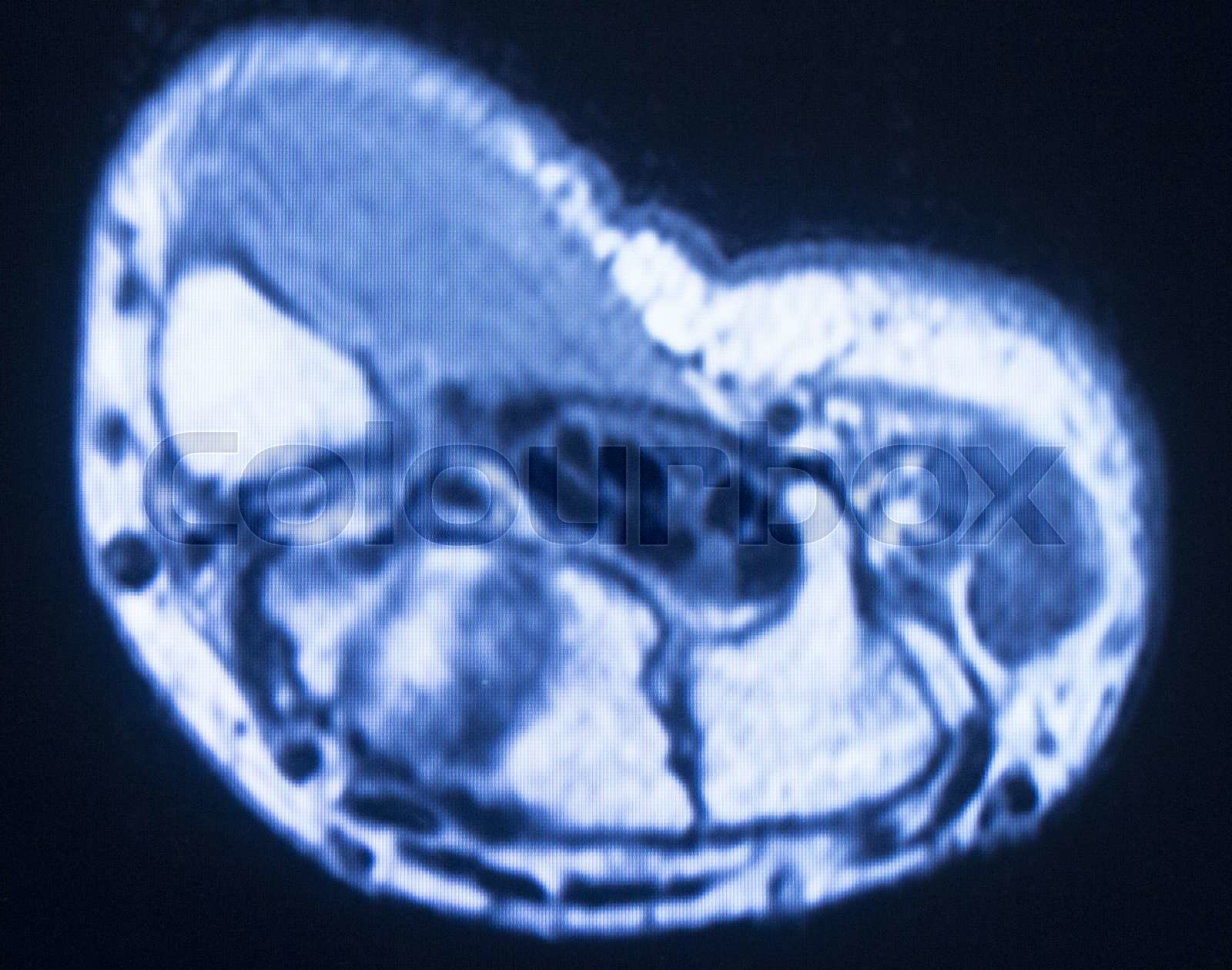 MRI magnetic resonance imaging hand fingers scan | Stock image | Colourbox