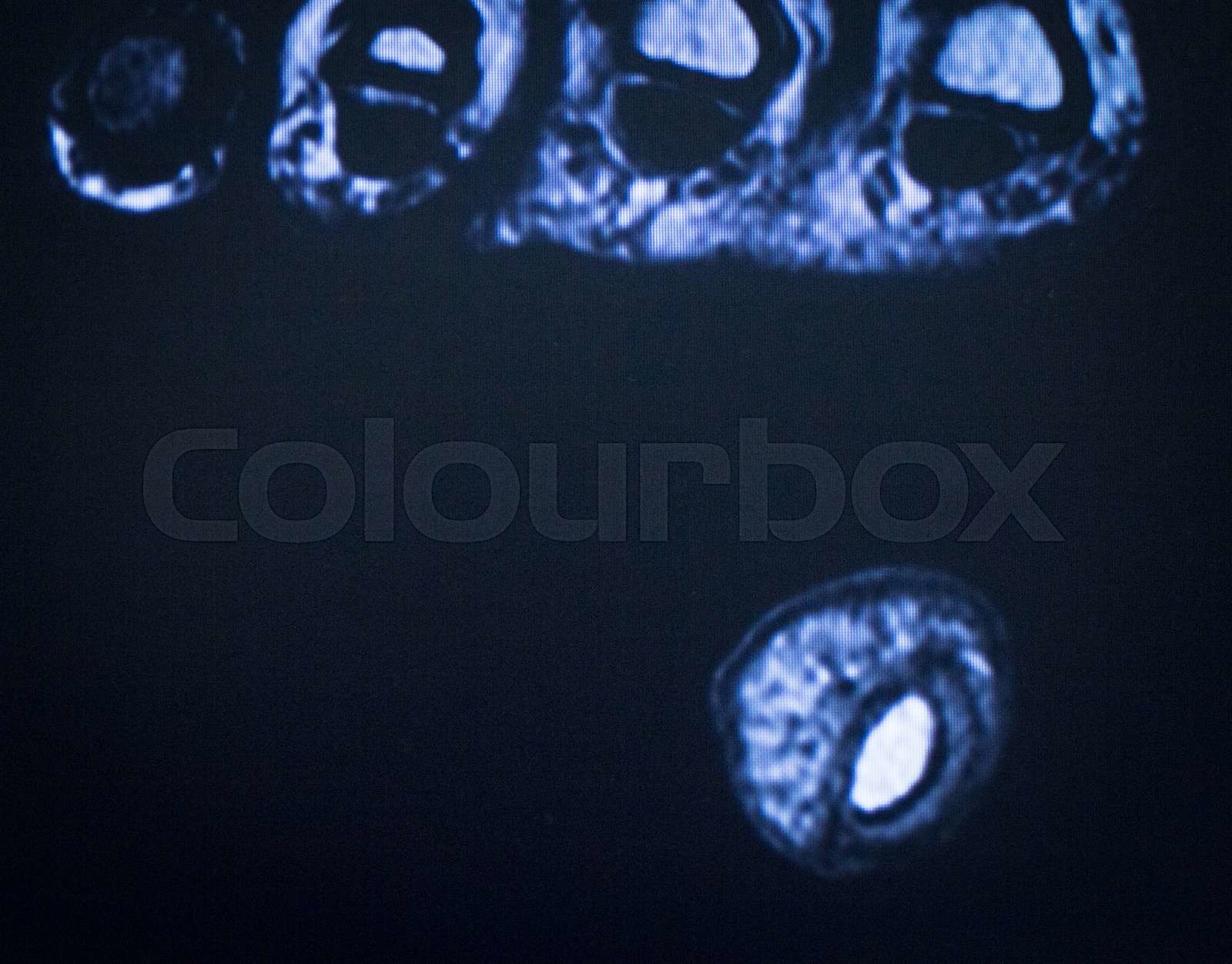 MRI magnetic resonance imaging foot toes scan - Stock Image - Everypixel