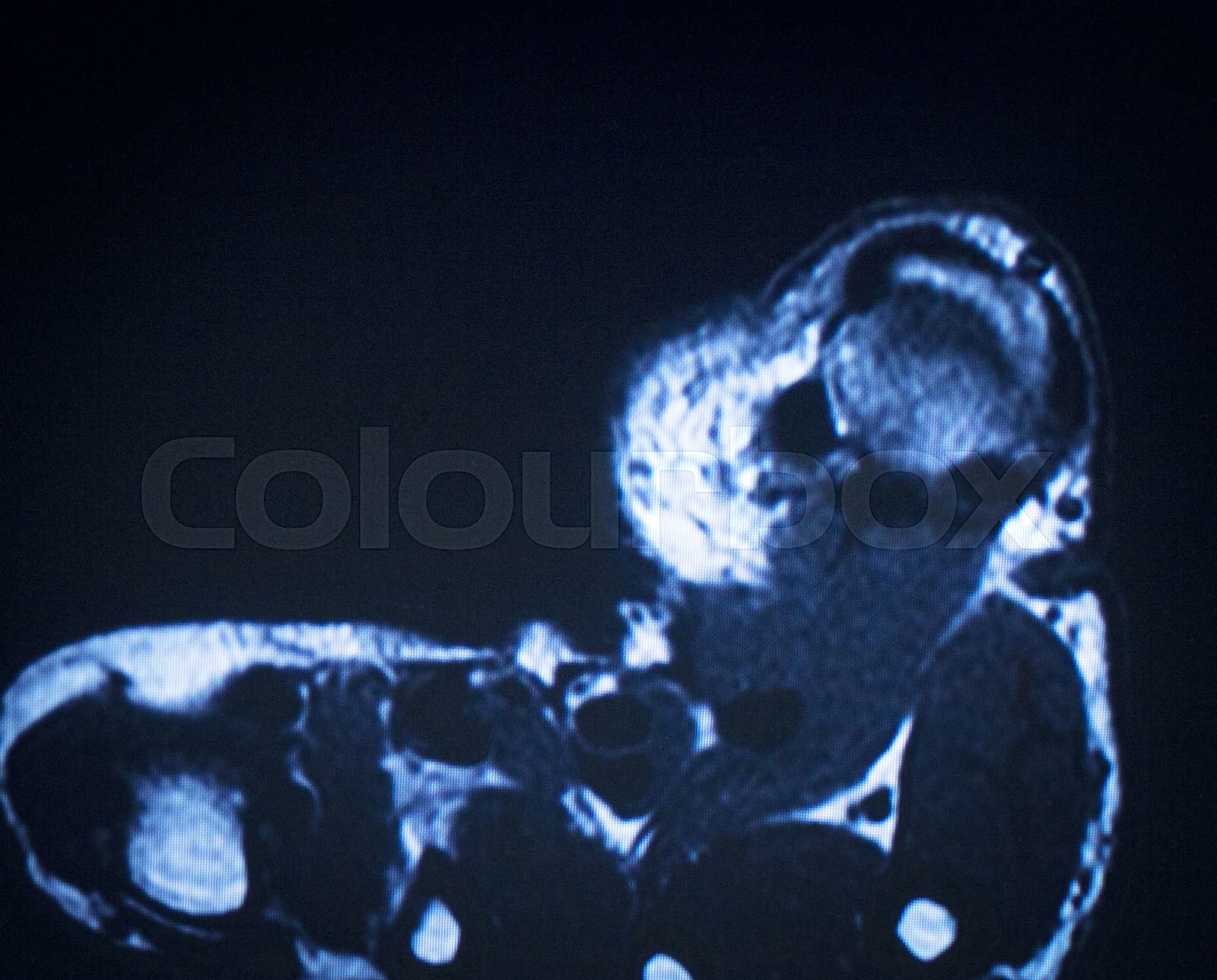 MRI magnetic resonance imaging foot toes scan | Stock image | Colourbox