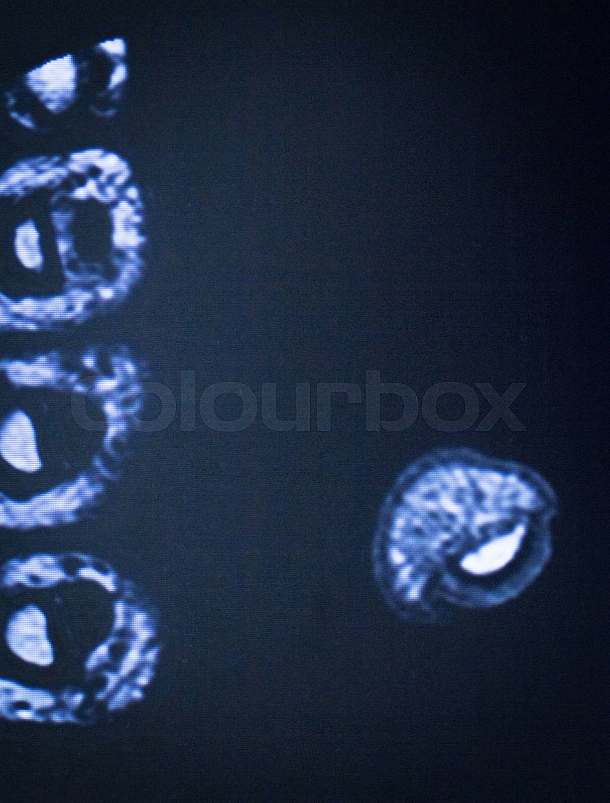 MRI magnetic resonance imaging foot toes scan | Stock image | Colourbox