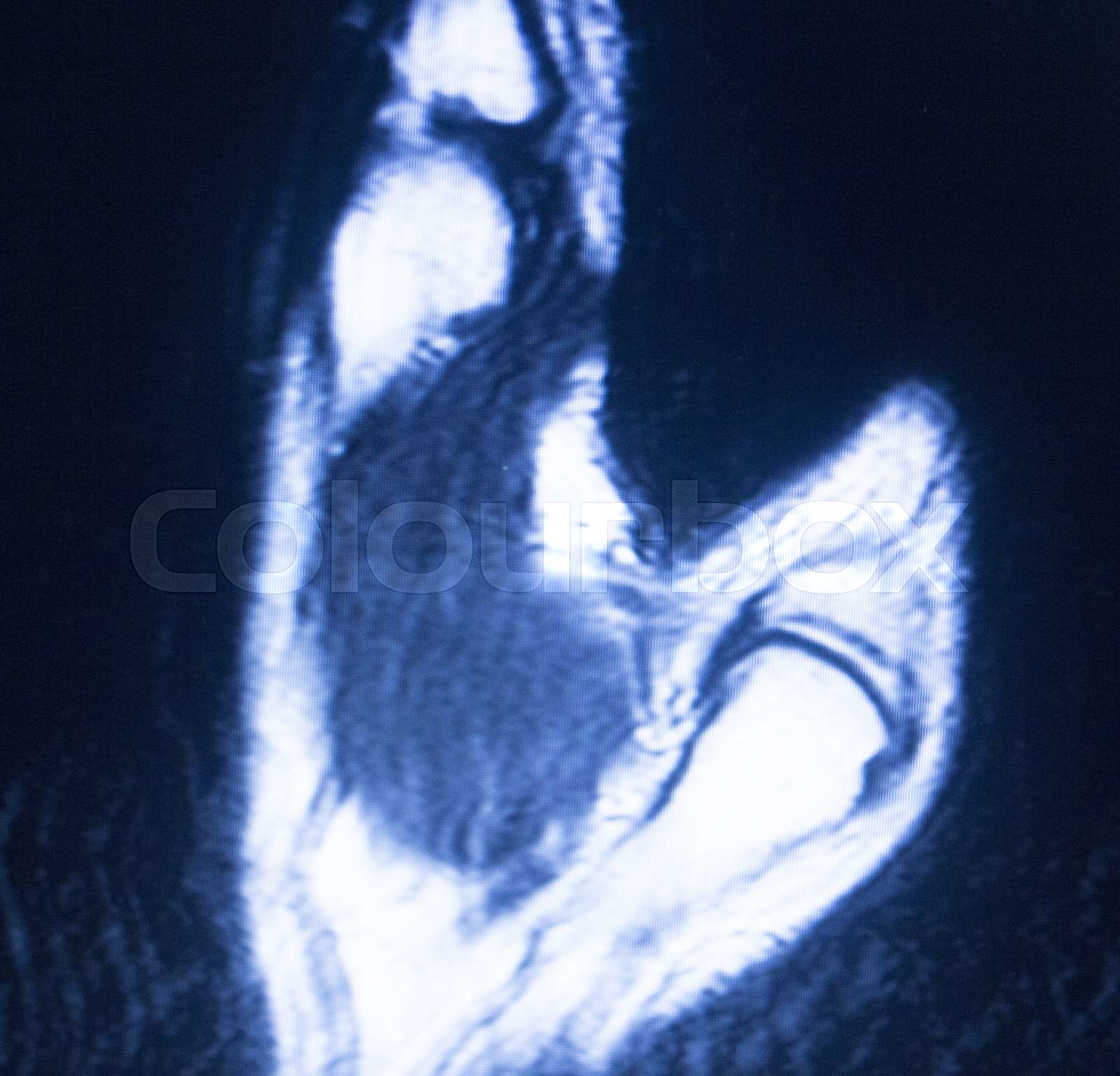 MRI magnetic resonance imaging hand carpal scan | Stock image | Colourbox