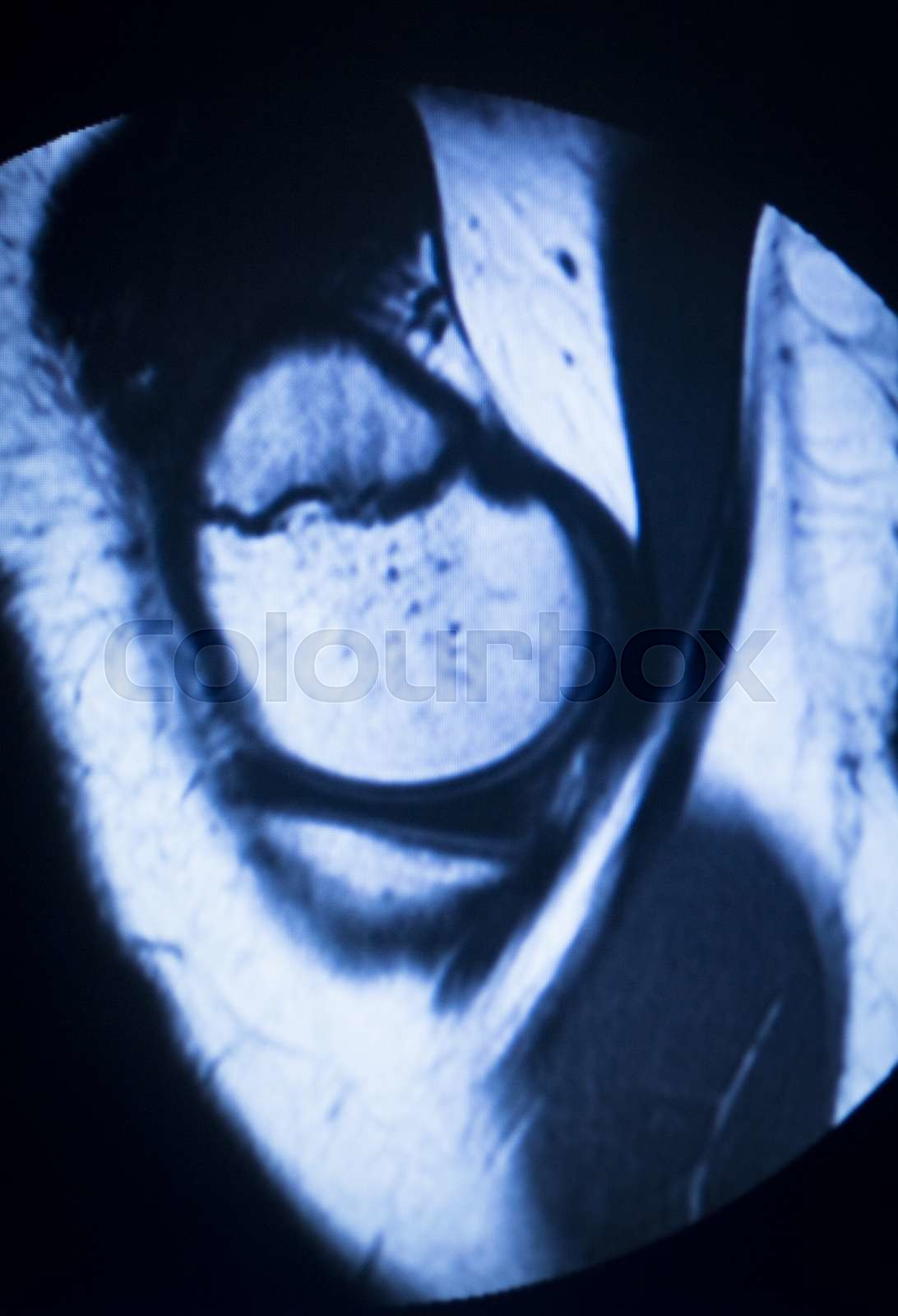 MRI magnetic resonance imaging medical scan | Stock image | Colourbox