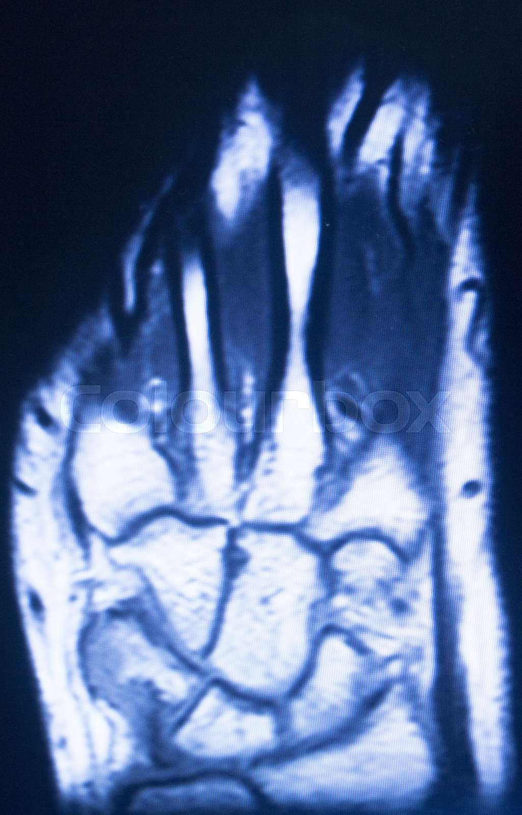 MRI magnetic resonance imaging hand finger scan | Stock image | Colourbox