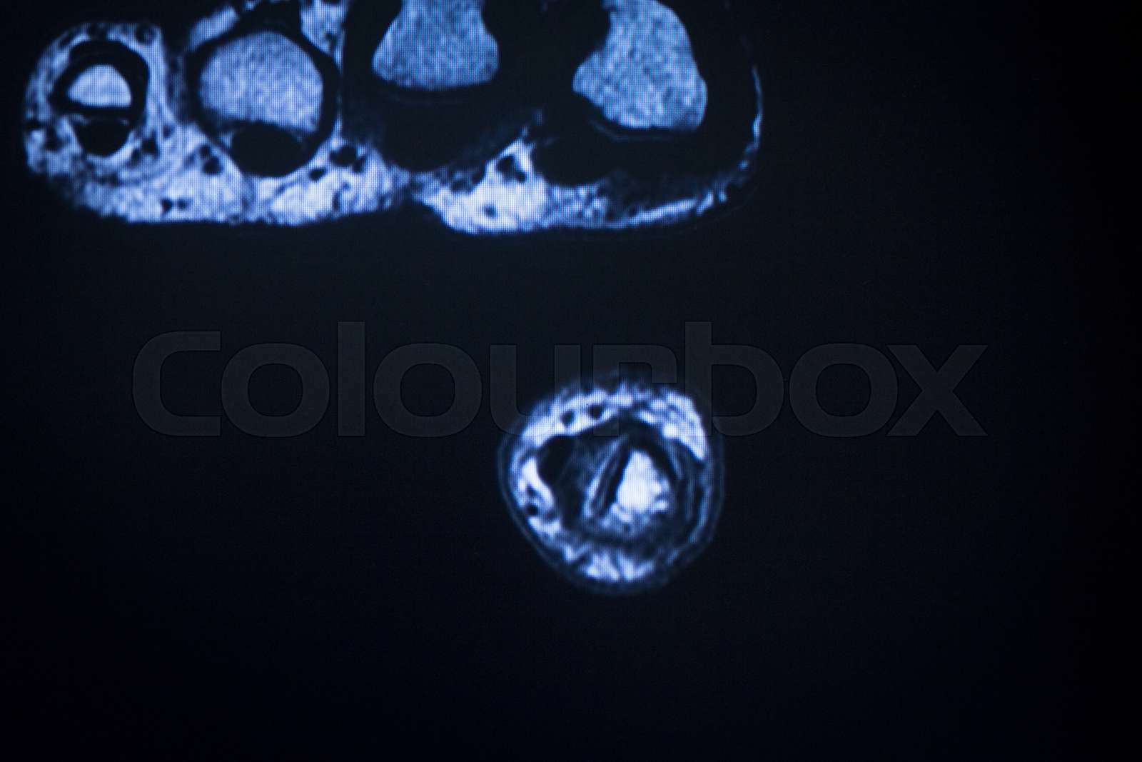 MRI magnetic resonance imaging foot toes scan | Stock image | Colourbox
