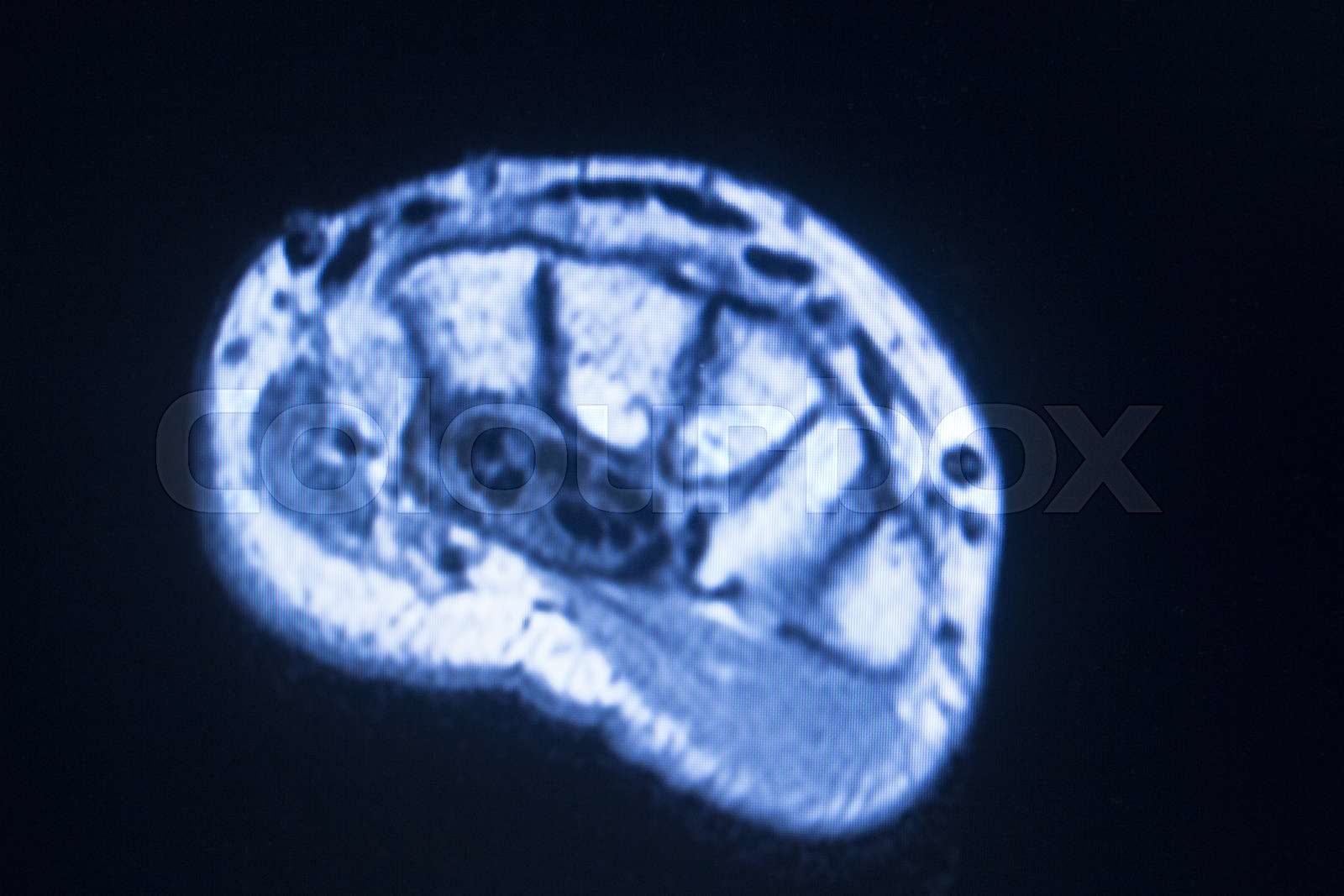 MRI magnetic resonance imaging hand fingers scan | Stock image | Colourbox