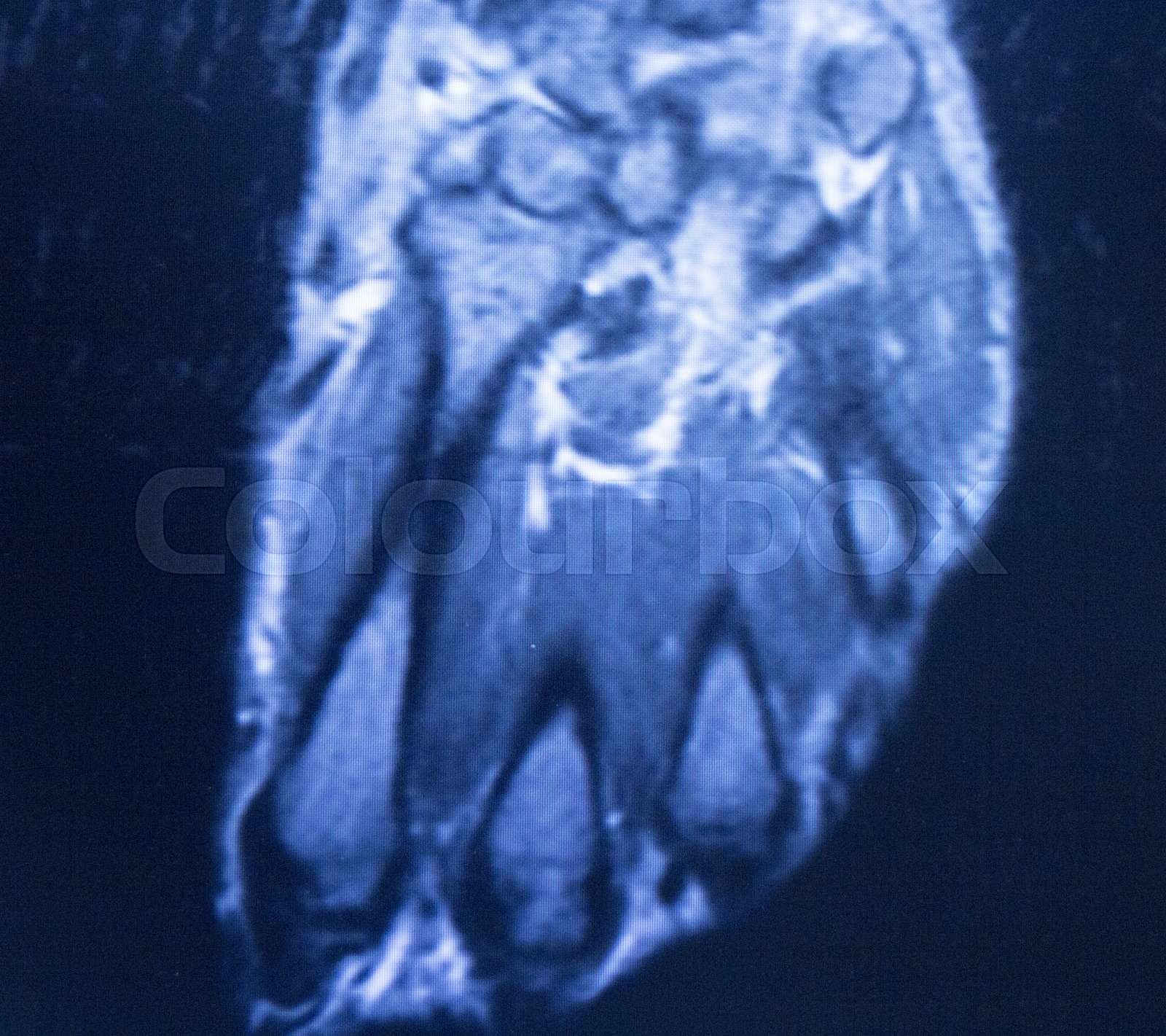 MRI magnetic resonance imaging hand finger scan | Stock image | Colourbox