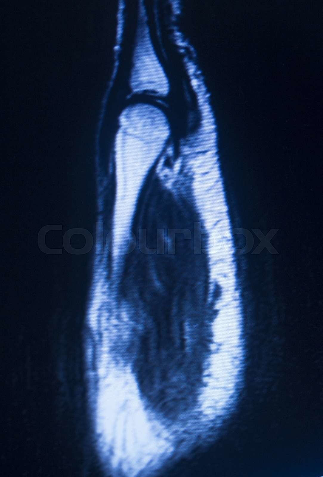 MRI magnetic resonance imaging hand carpal scan | Stock image | Colourbox