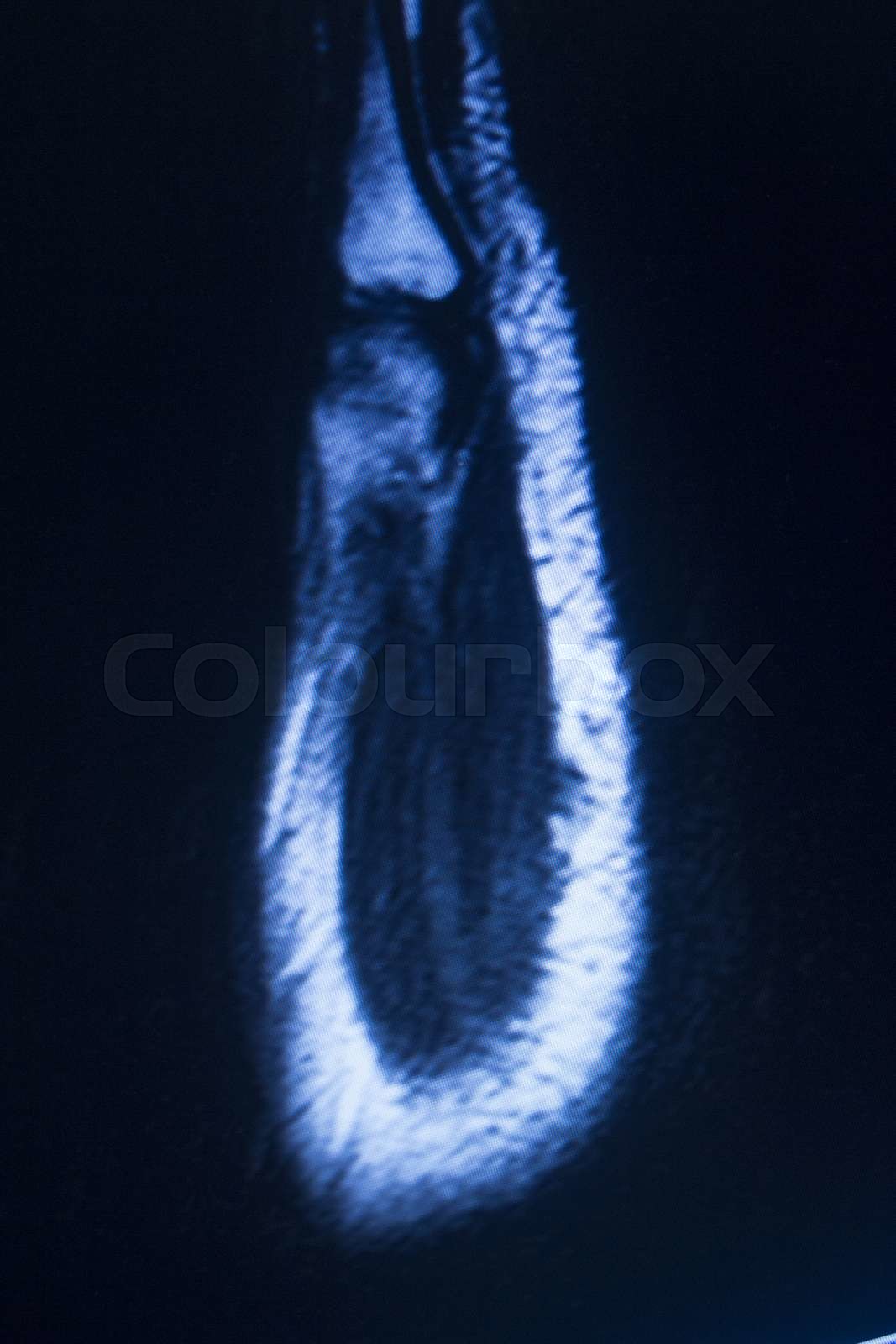 MRI magnetic resonance imaging hand carpal scan | Stock image | Colourbox