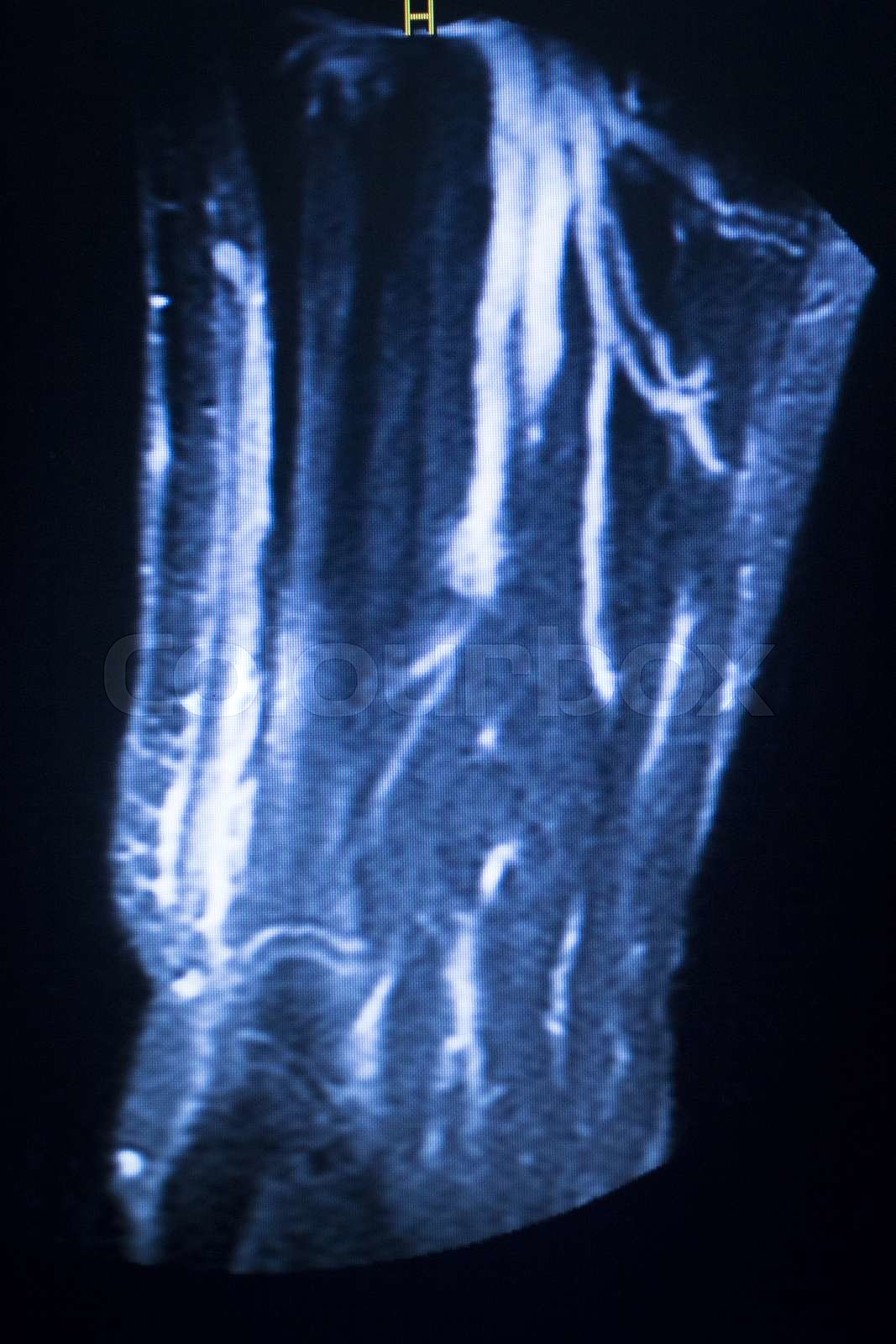 MRI magnetic resonance imaging medical scan | Stock image | Colourbox