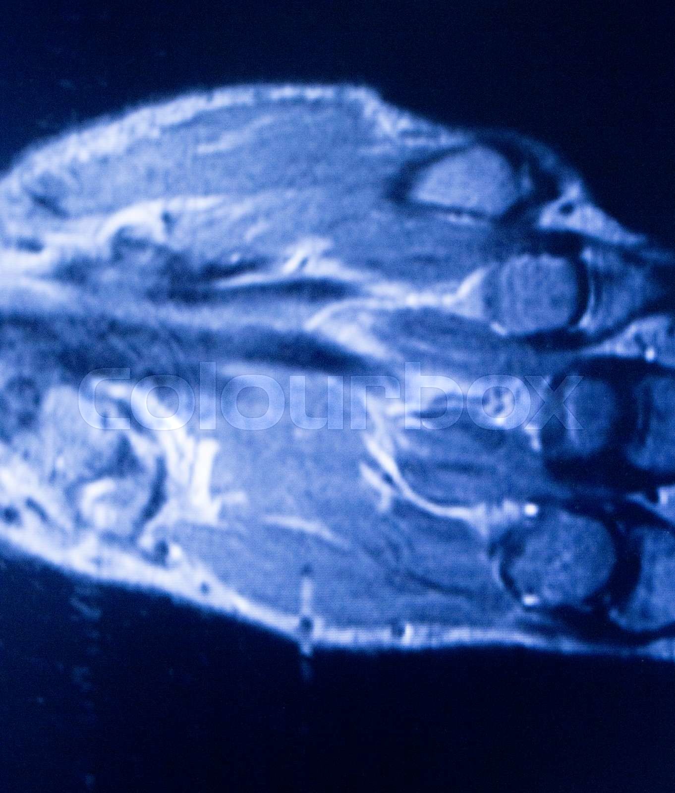 MRI magnetic resonance imaging hand finger scan | Stock image | Colourbox